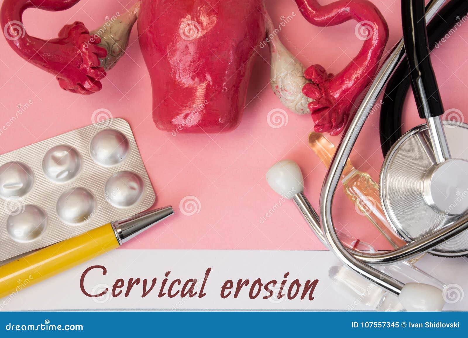 Diagnosis Of Cervical Erosion Medical History Of Patient With