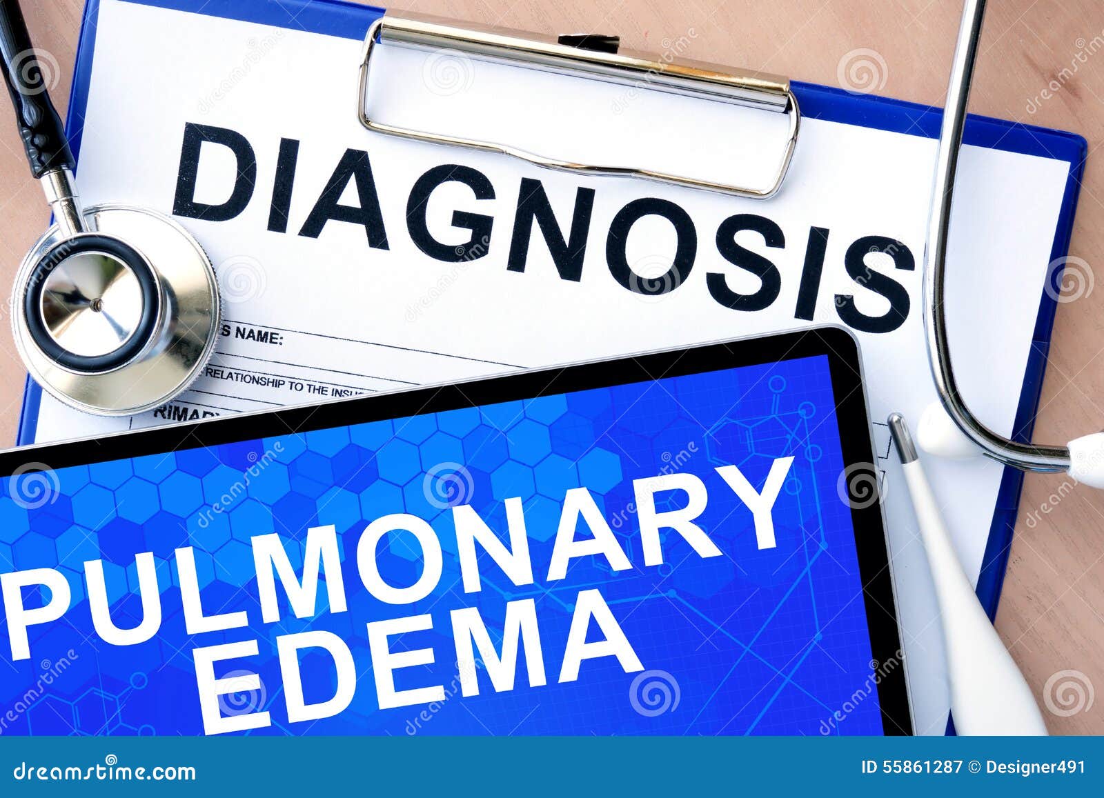 Diagnosis and Tablet with Pulmonary Edema Stock Image - Image of ...