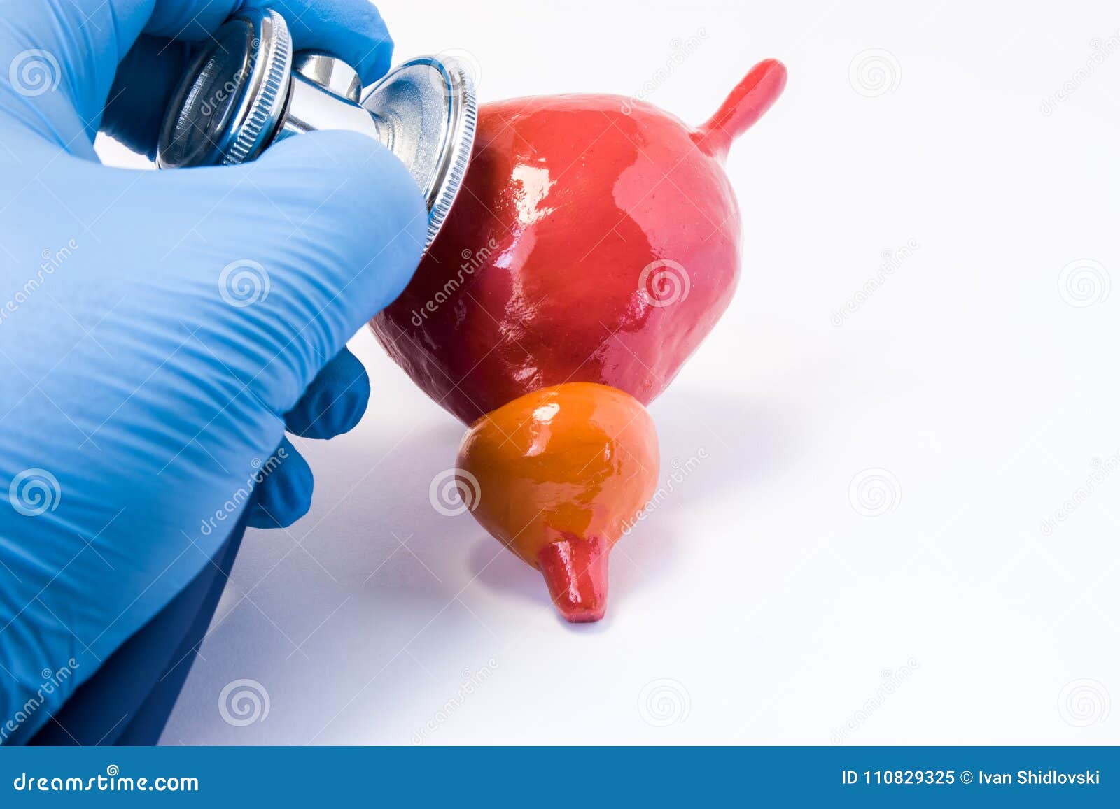 Urine Bladder Suprapubic Puncture Biopsy Or Cystoscopy Procedure ... Urine Bladder Suprapubic Puncture Biopsy Or Cystoscopy Procedure ...
