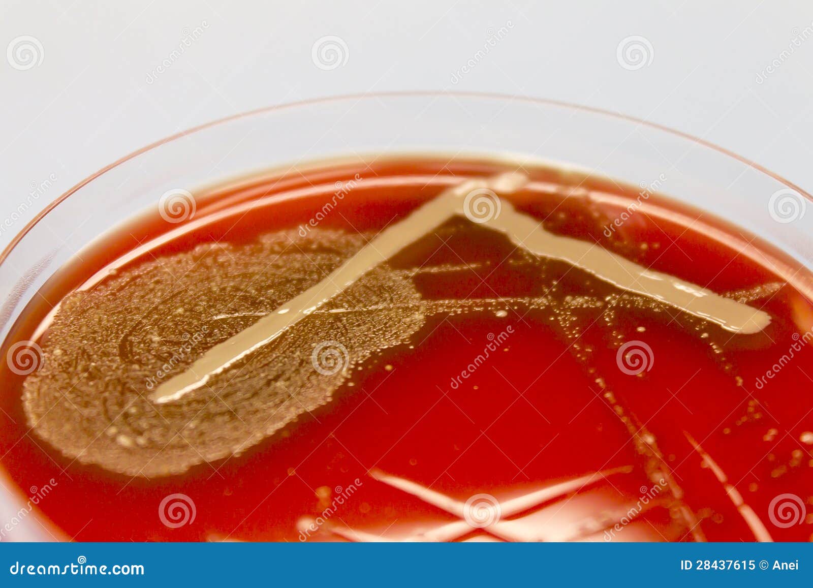 Diagnostic Bacterial Culture On Red Agar Stock Photo | CartoonDealer ...