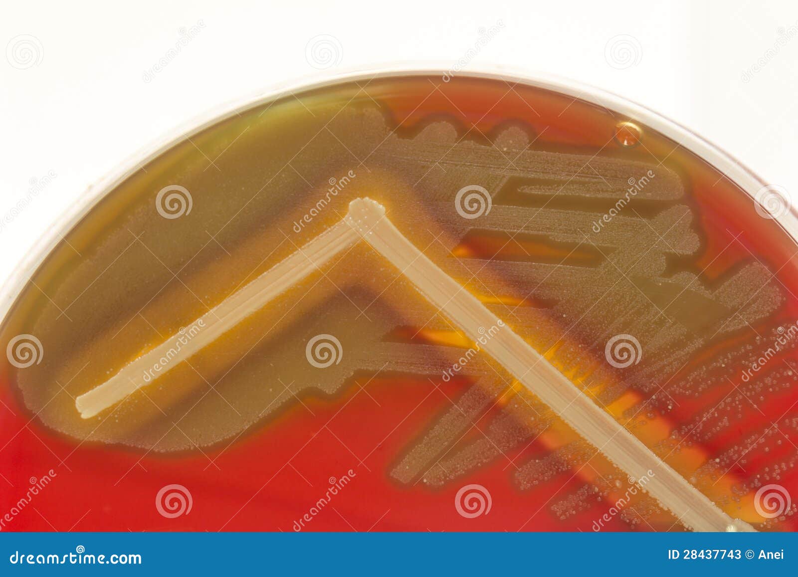Diagnostic Bacterial Culture On Red Agar Stock Photo | CartoonDealer ...