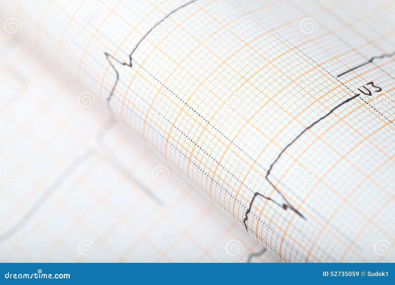Diagnostic ECG Chart Concept Stock Image - Image of cardiologist ...