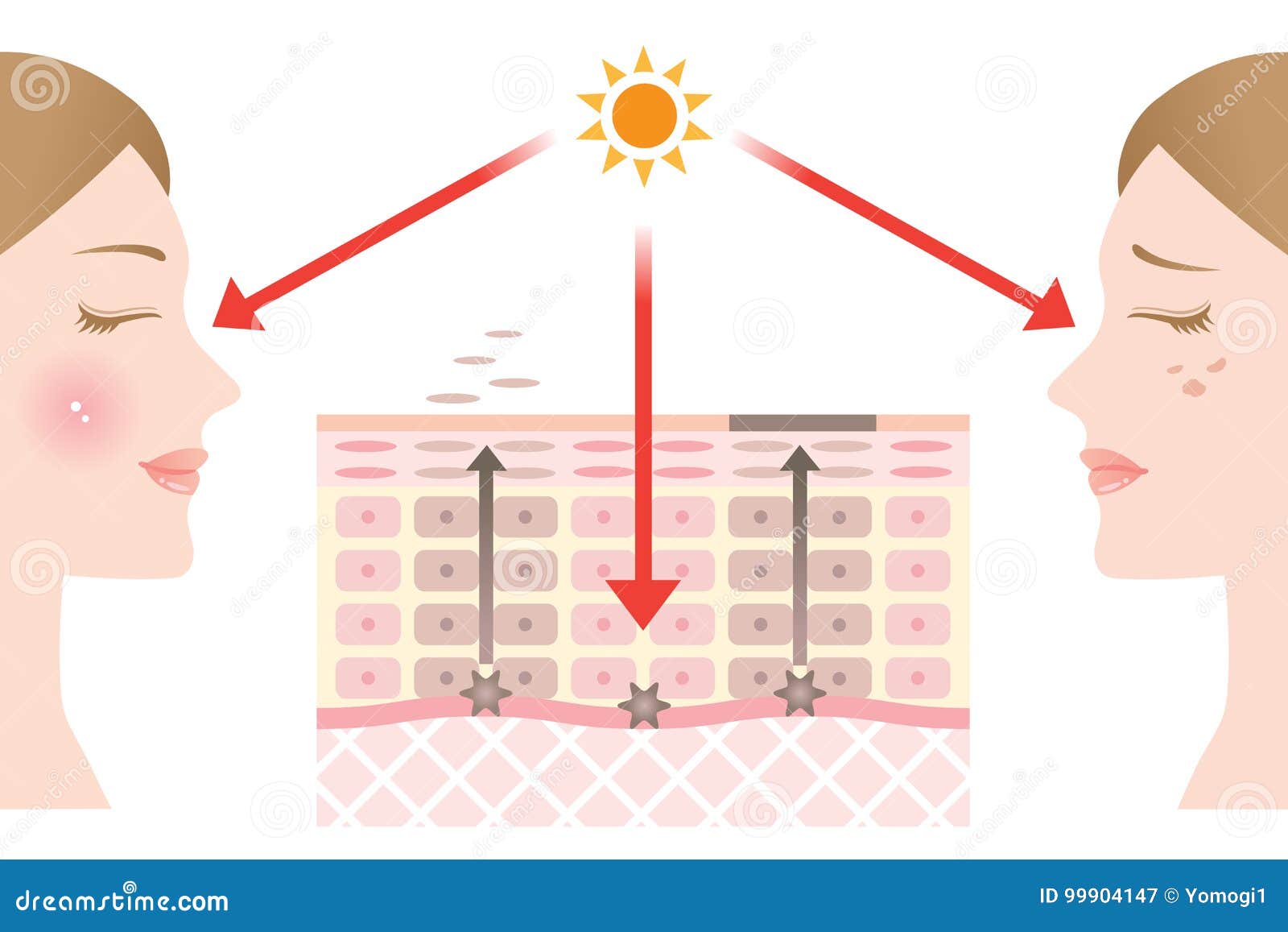 Diagram of Regular Skin Cell Turnover and Slow Skin Cell Turnover Stock ... Diagram of Regular Skin Cell Turnover and Slow Skin Cell Turnover Stock ...