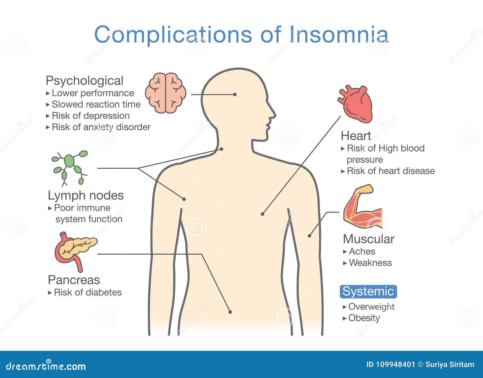 Diagram Van Complicaties Van Slapeloosheid Vector Illustratie ...