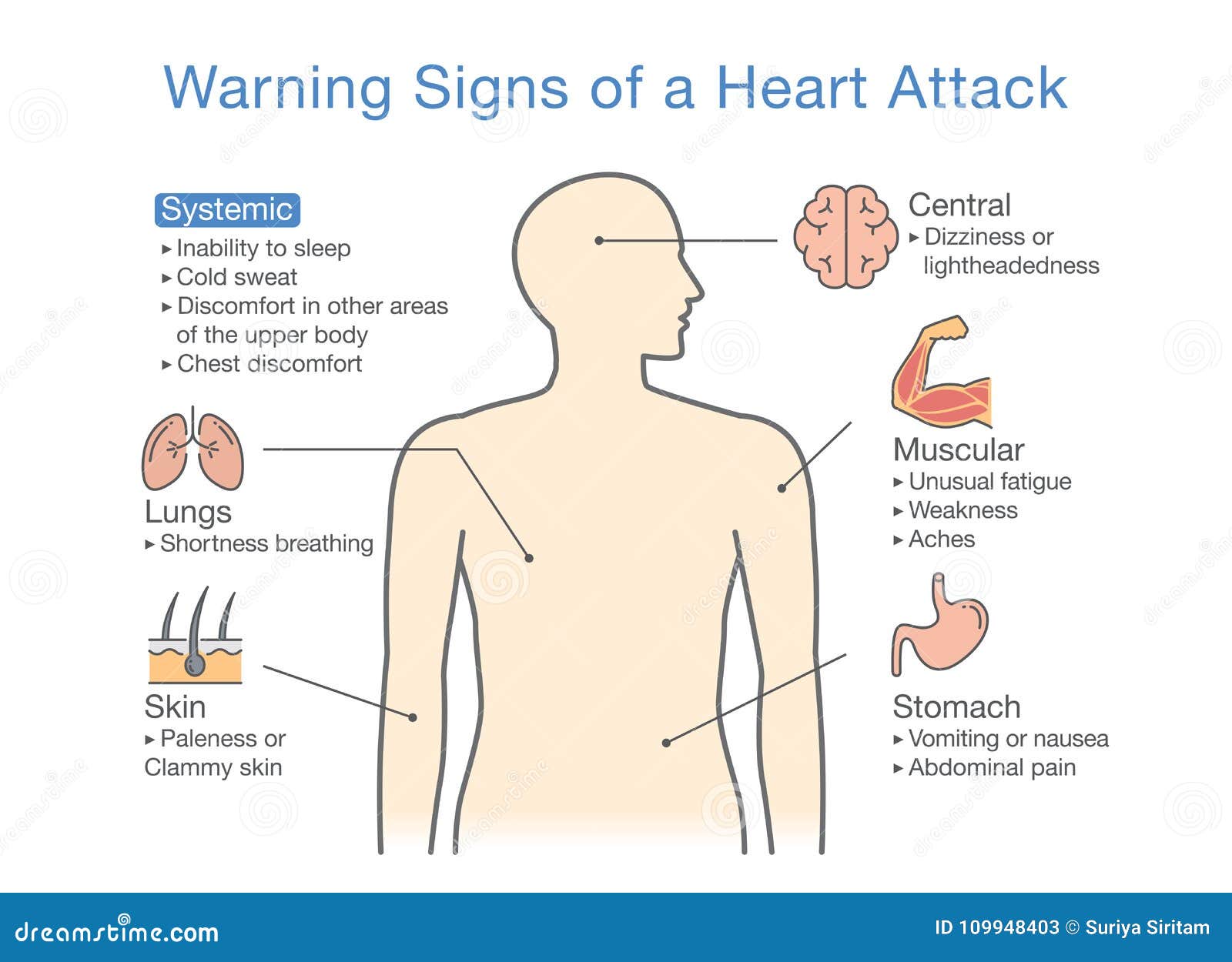 Diagram About Warning Signs Of A Heart Attack Stock Vector
