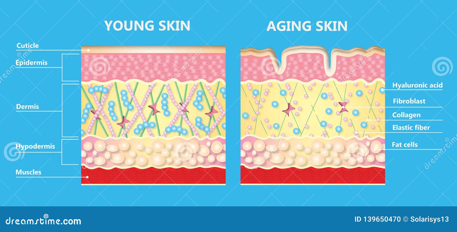 The Diagram Of Younger Skin And Aging Skin Stock Photo | CartoonDealer ...