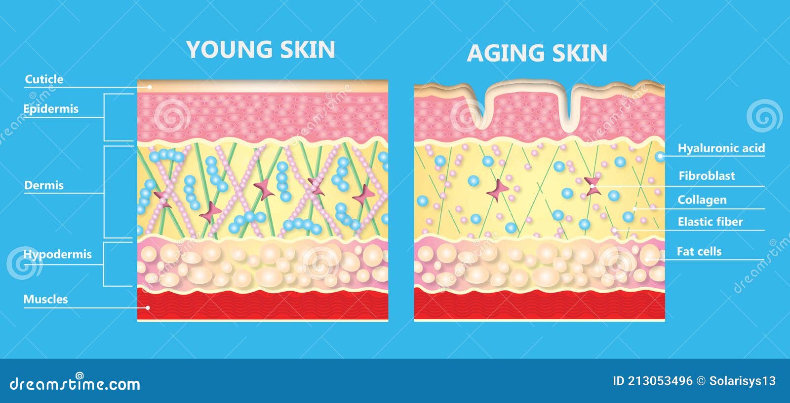 The Diagram of Younger Skin and Aging Skin Stock Vector - Illustration ...
