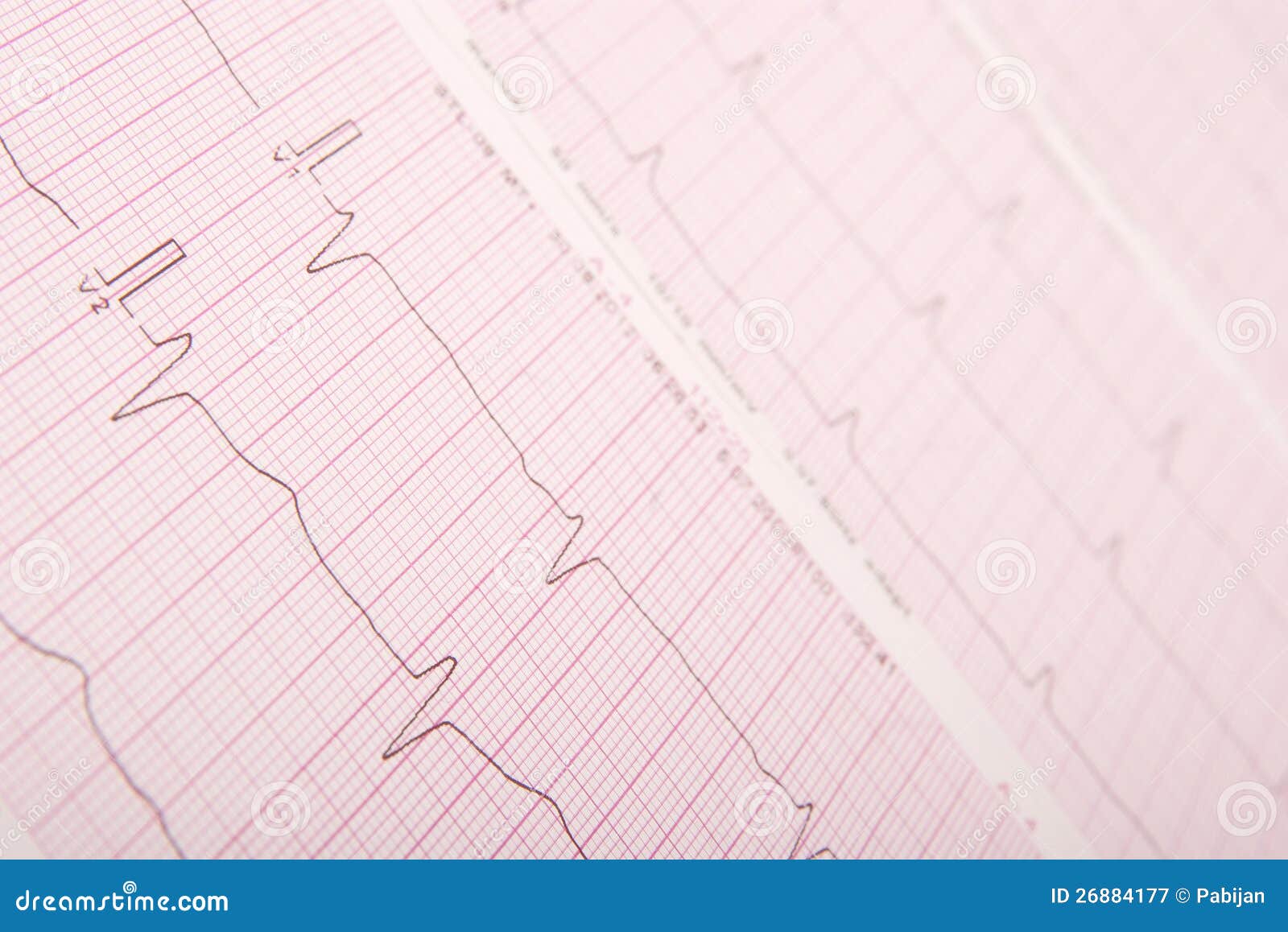 Diagramma Di ECG (risultati Di ECG) Immagine Stock - Immagine di salute ...