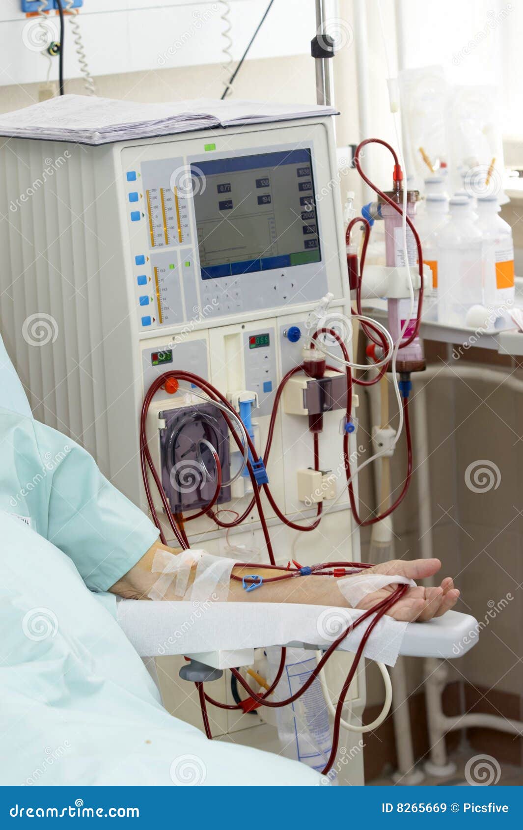 Dialysis 7 stock image. Image of lying, kidneys, disease - 8265669