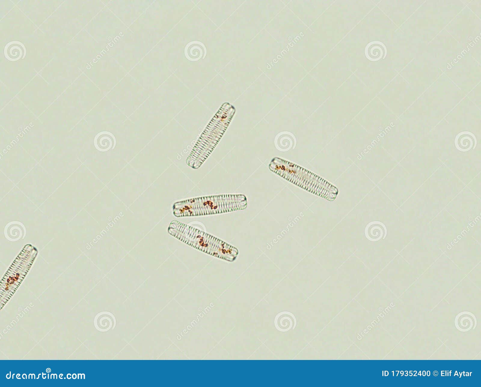 Diatom Algae Under Microscopic View X100, Freshwater Stock Photo ...