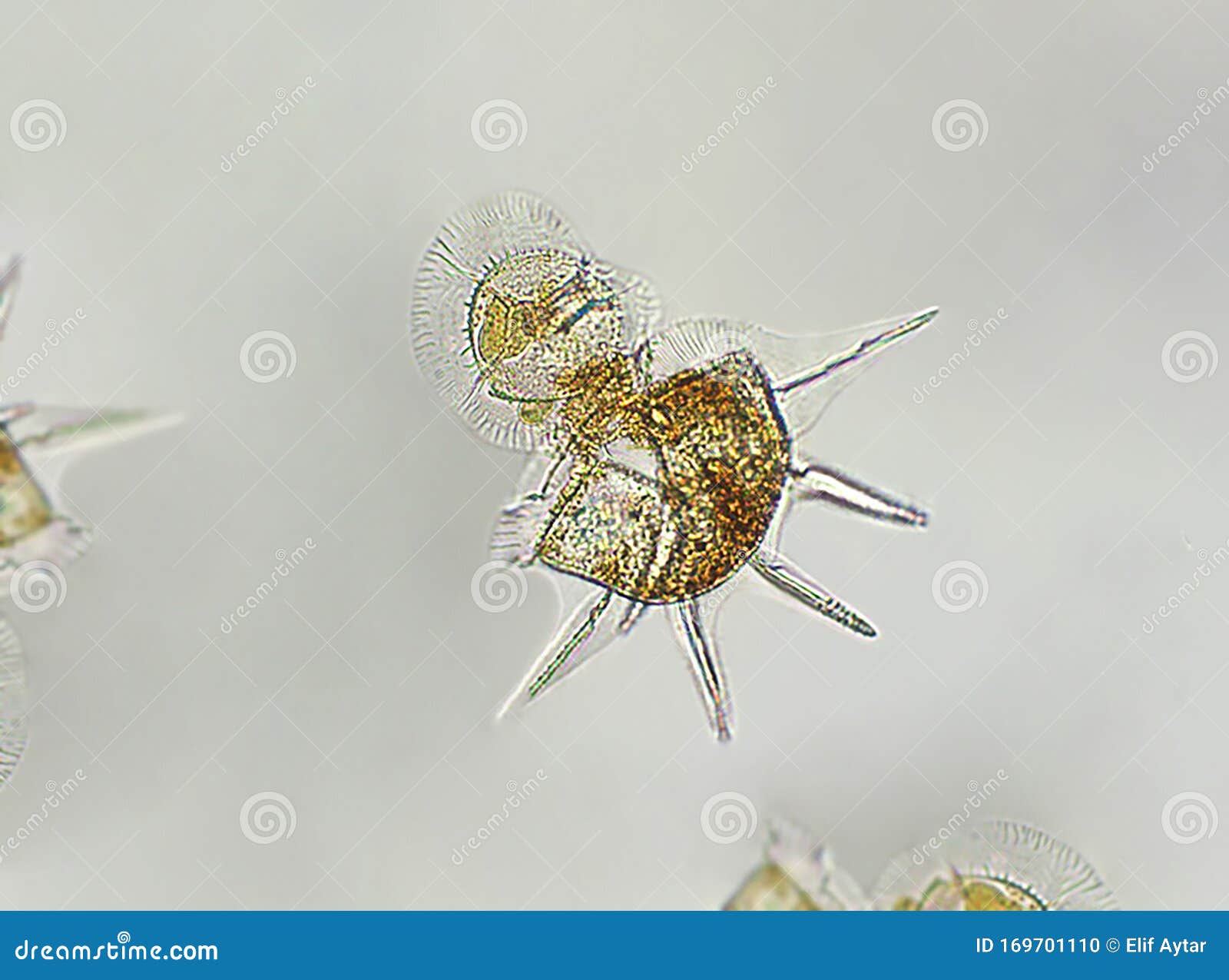 Diatom, Golden Yellow Algae Under Microscopic View Stock Illustration ...