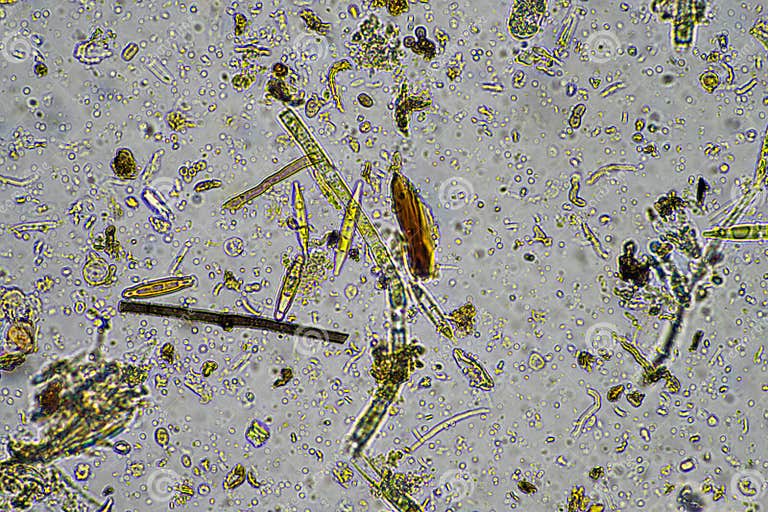 Diatom and Water Microorganisms Under the Microscope Stock Photo ...