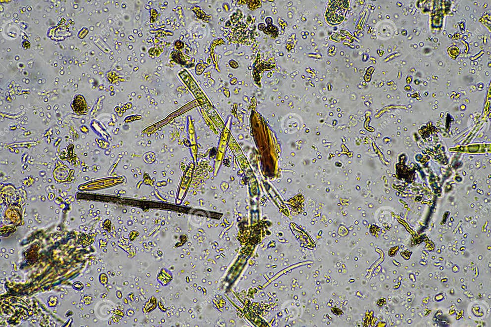 Diatom and Water Microorganisms Under the Microscope Stock Photo ...