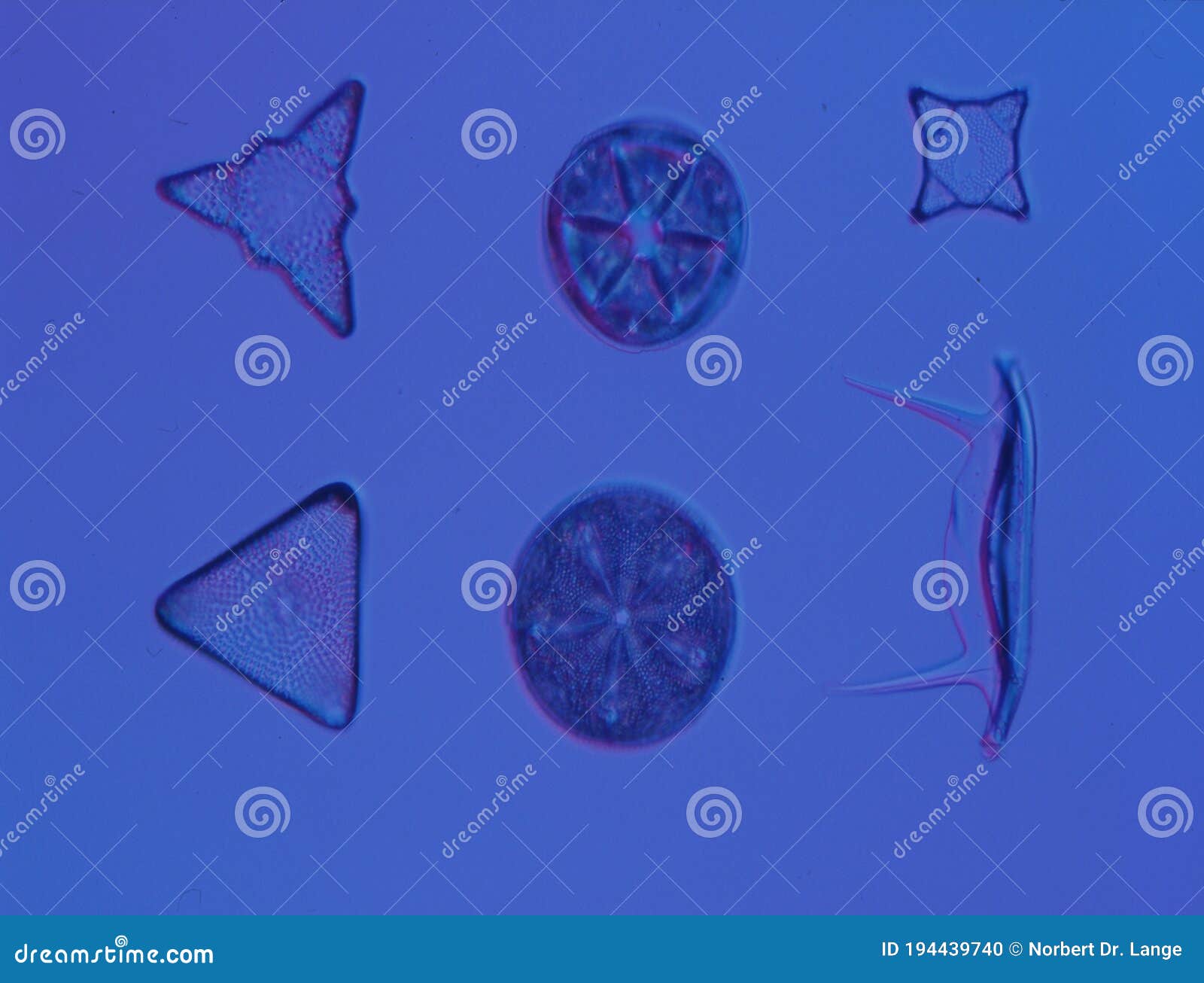 Diatomas Del Mar Bajo El Microscopio Foto de archivo - Imagen de ...