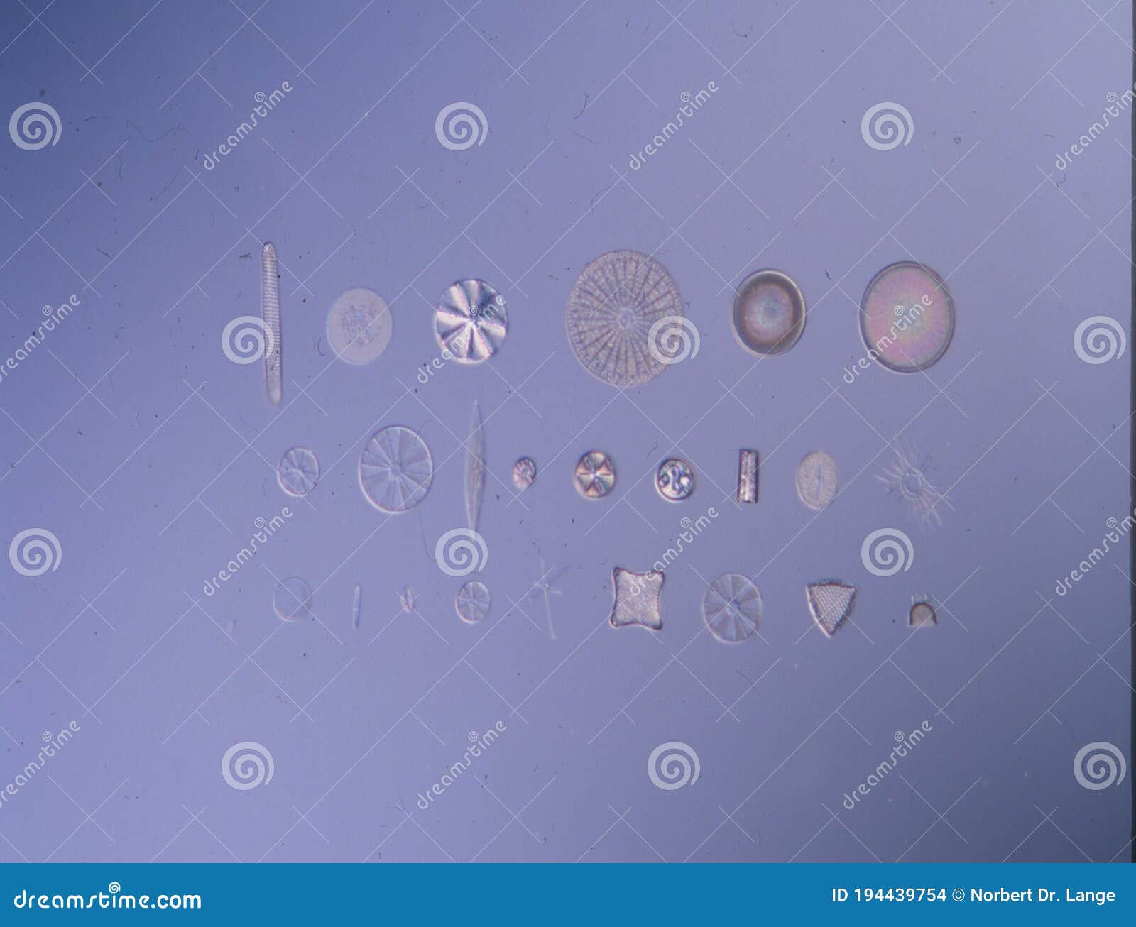 Diatomas Del Mar Bajo El Microscopio Foto de archivo - Imagen de ...