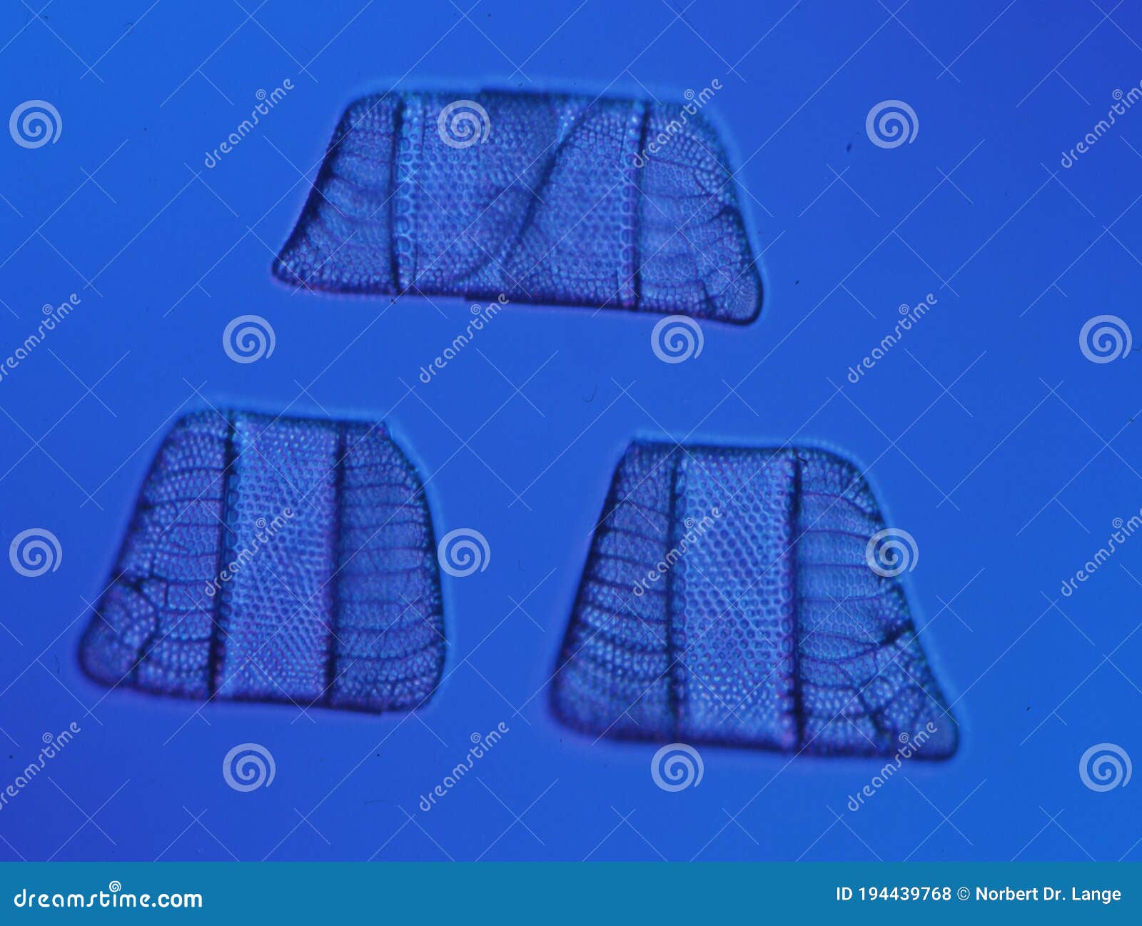 Diatomas Del Mar Bajo El Microscopio Foto de archivo - Imagen de verde ...