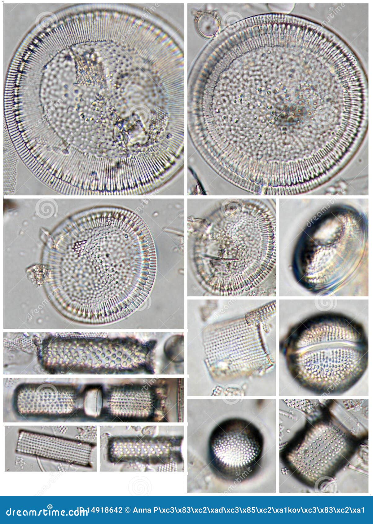 Diatomeas - Cyclotella Y Aulacoseira Spp. Foto de archivo - Imagen de ...