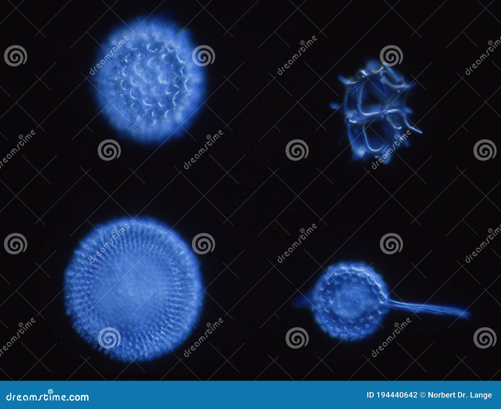 Diatoms from the Sea Under the Microscope Stock Photo - Image of ...