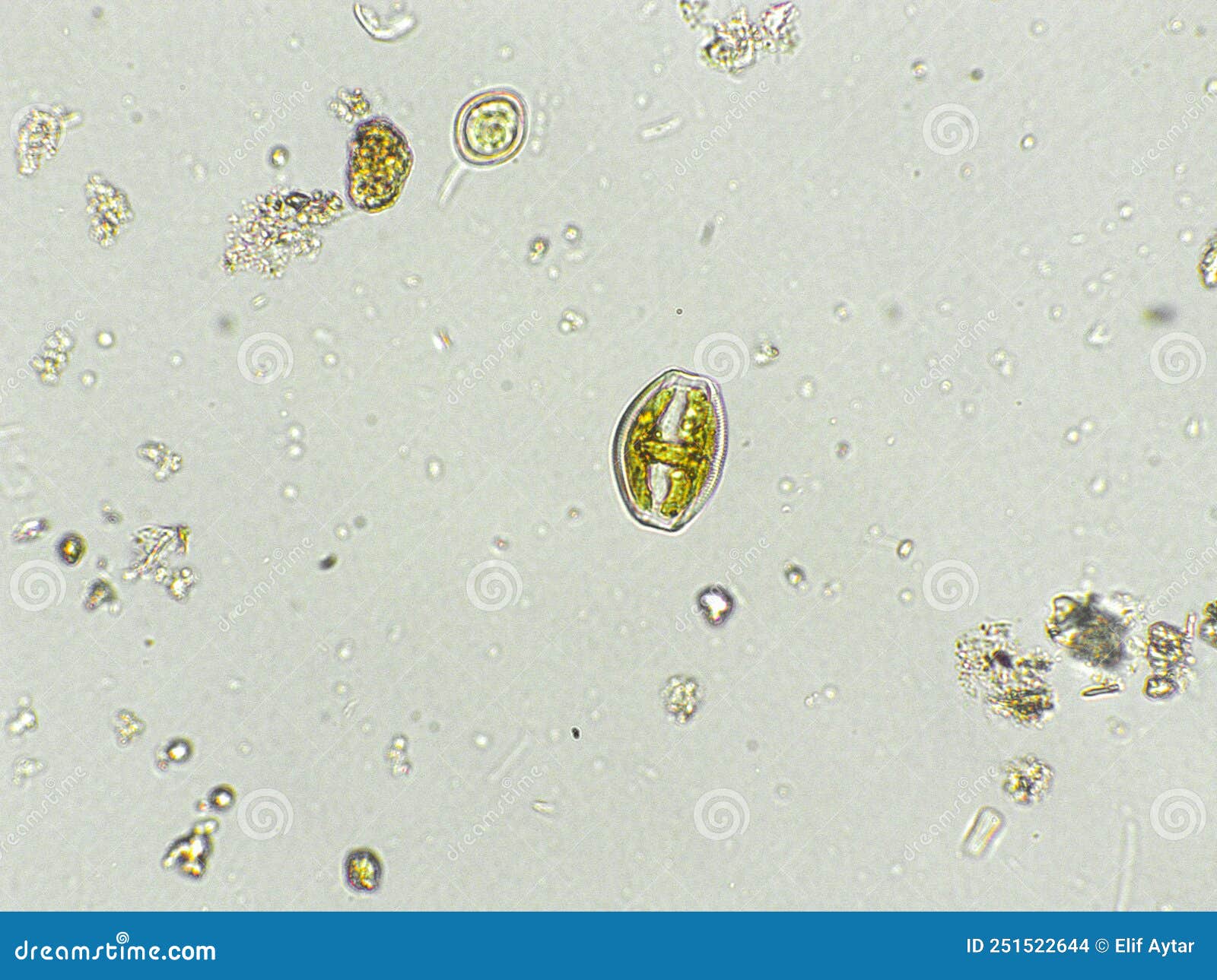 Diatoms Under Microscopic View Stock Photo - Image of alga, biological ...