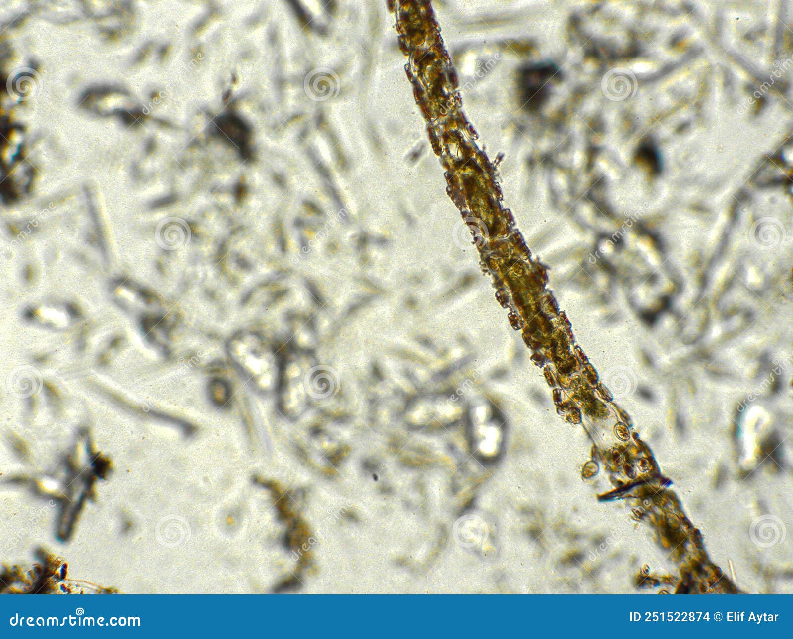 Diatoms Under Microscopic View Stock Photo - Image of diatomite ...