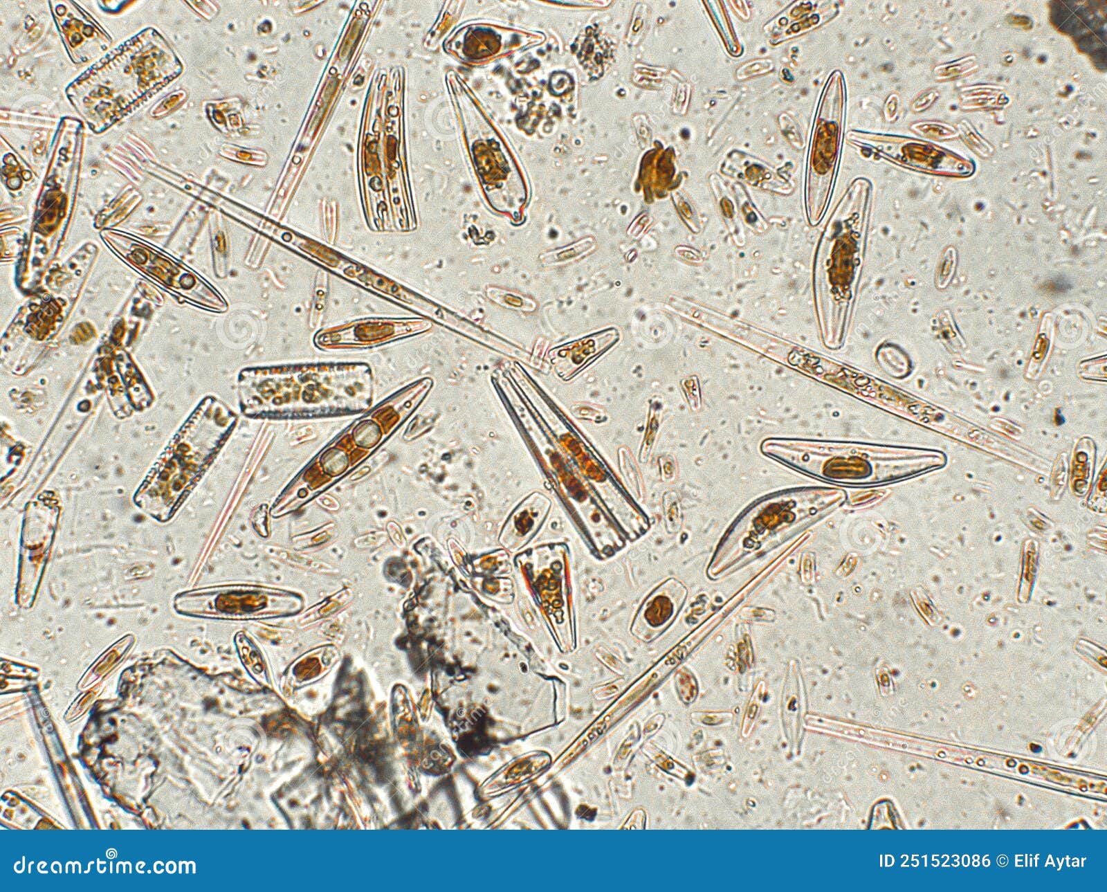 Diatomaceous Earth Under Microscope