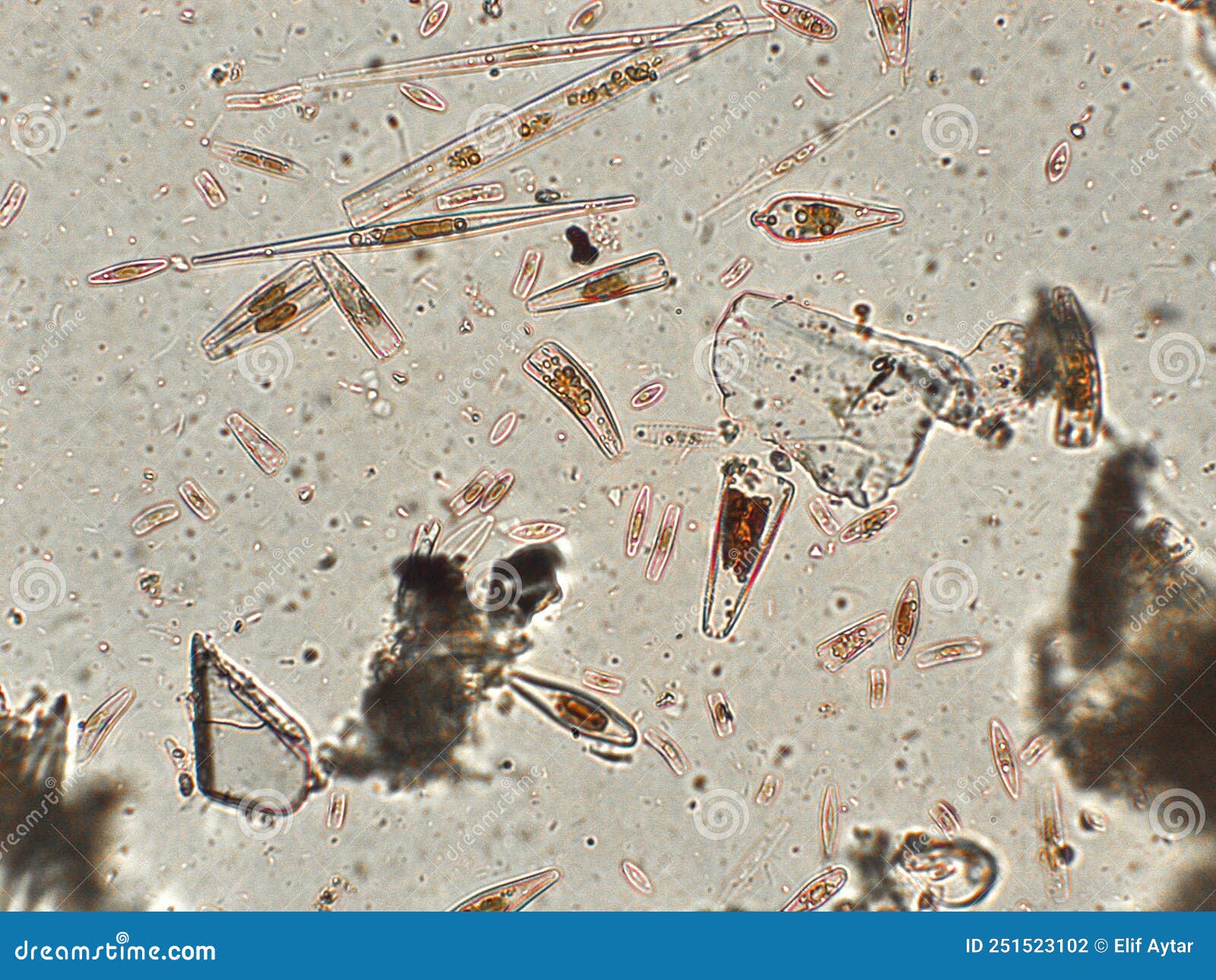 Diatomaceous Earth Under Microscope