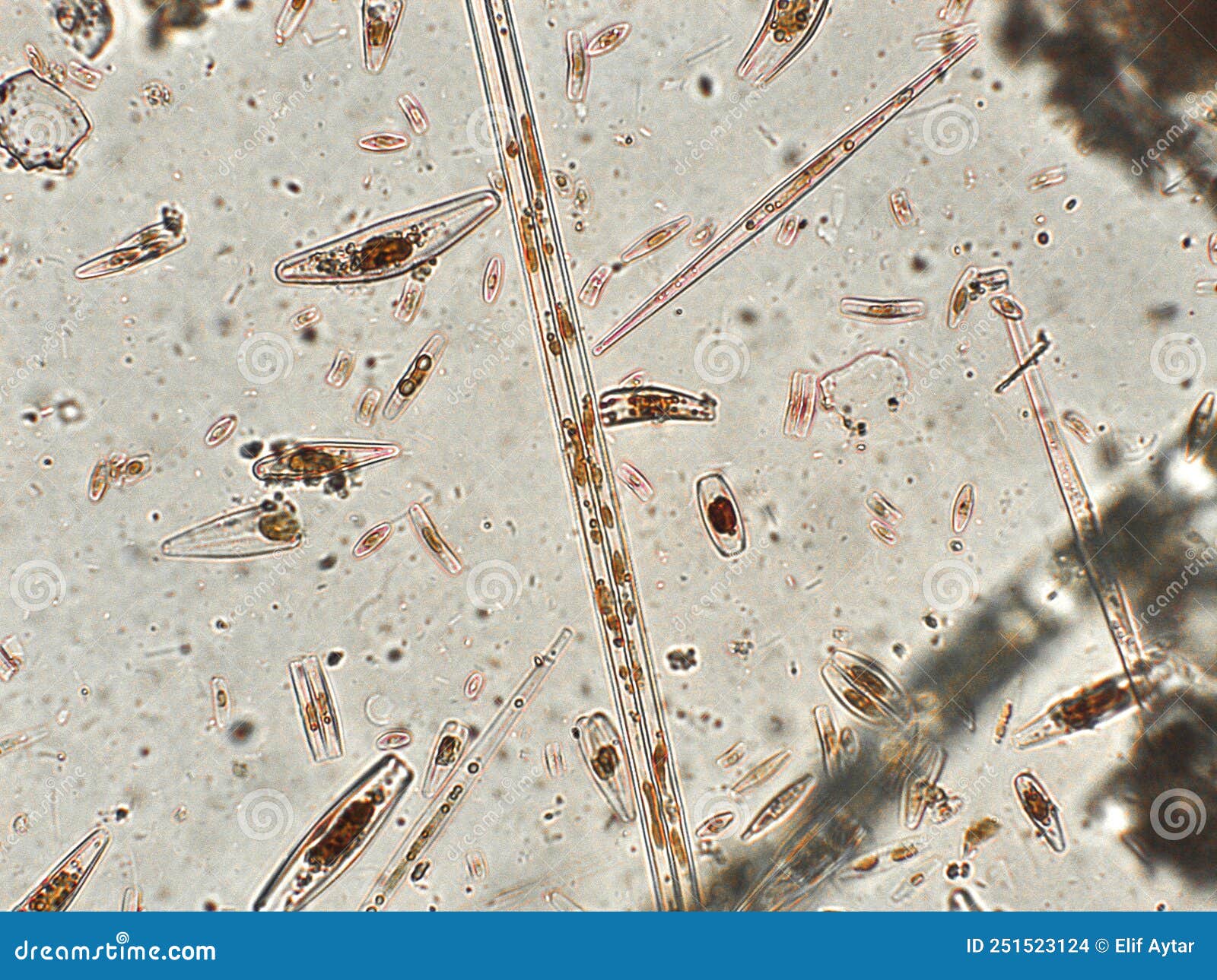 Diatomaceous Earth Under Microscope