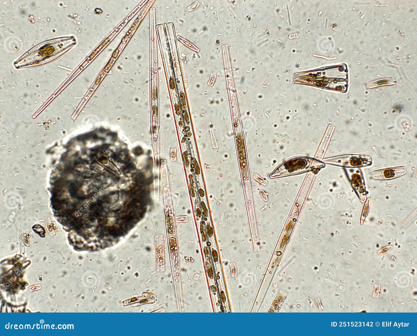 Diatomaceous Earth Under Microscope