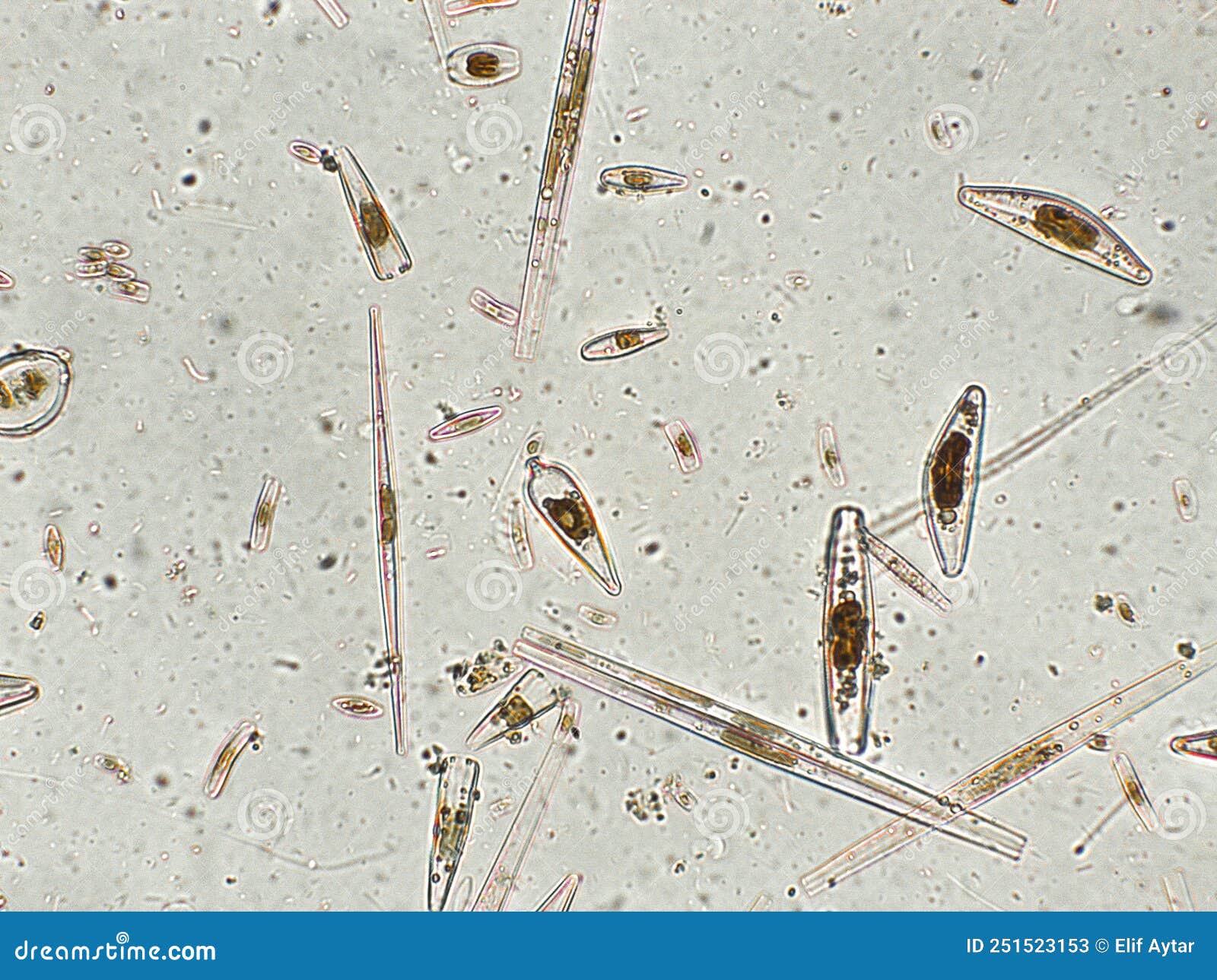 Diatoms From The Sea Under The Microscope Stock Photography ...