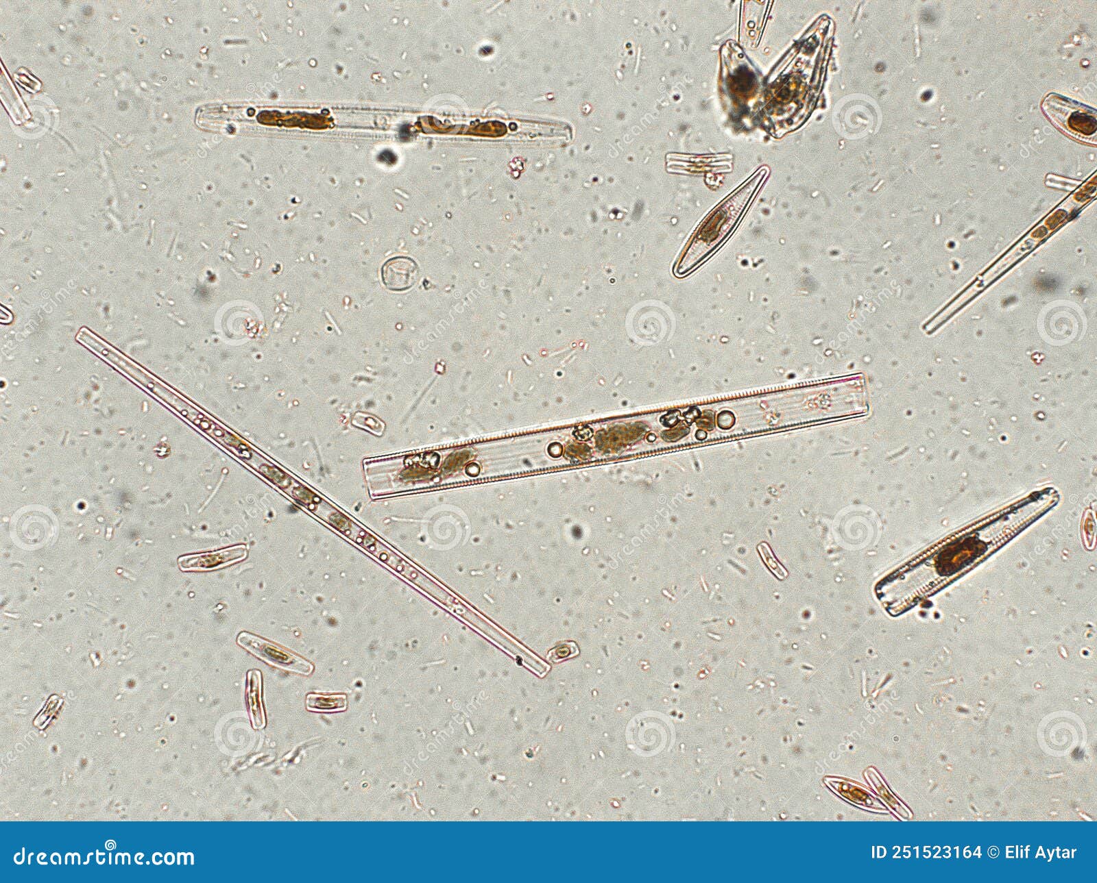 Diatoms From The Sea Under The Microscope Stock Photography ...