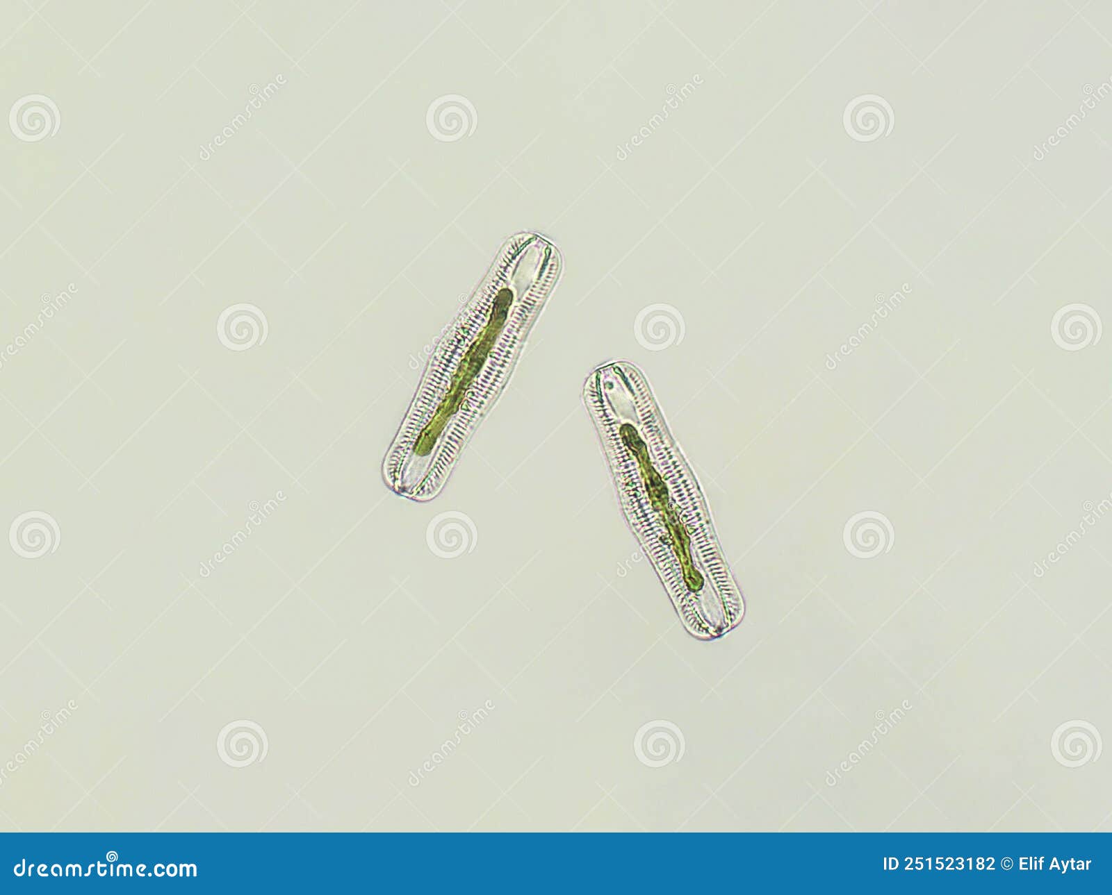 Diatoms Under Microscopic View Stock Photo - Image of microscopic ...