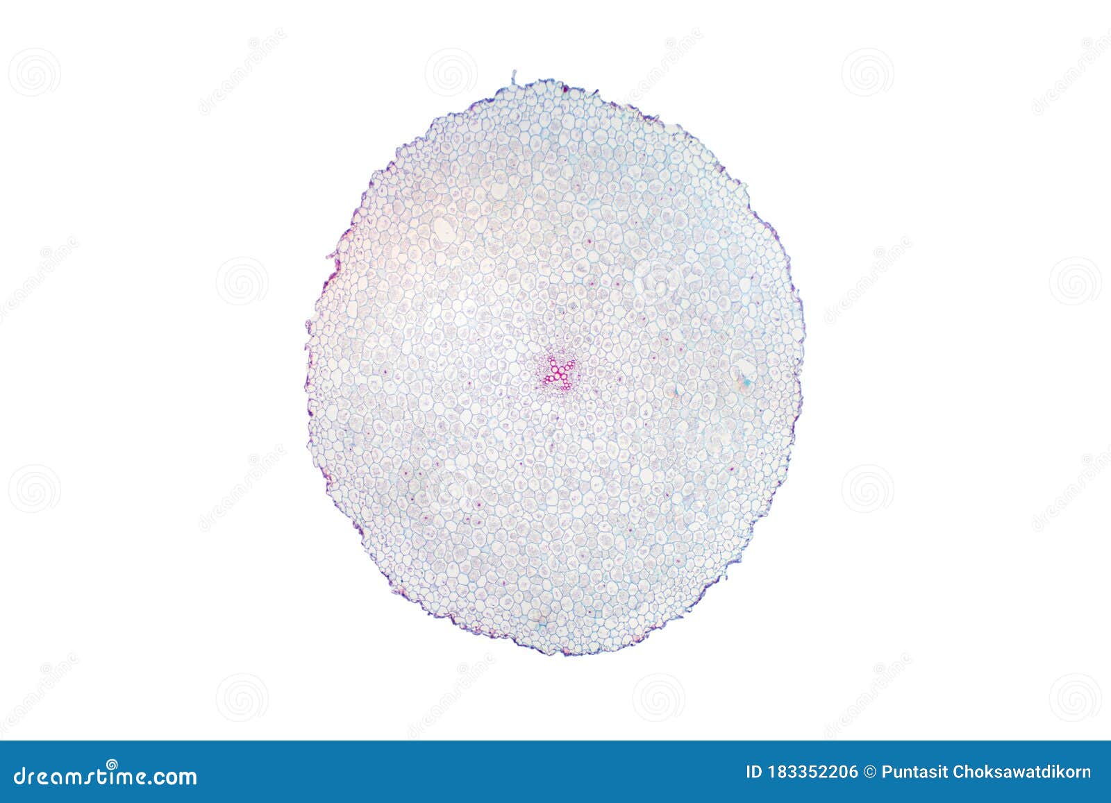 Dicot Root Cross Section Slide View Under Microscope for Botany ...