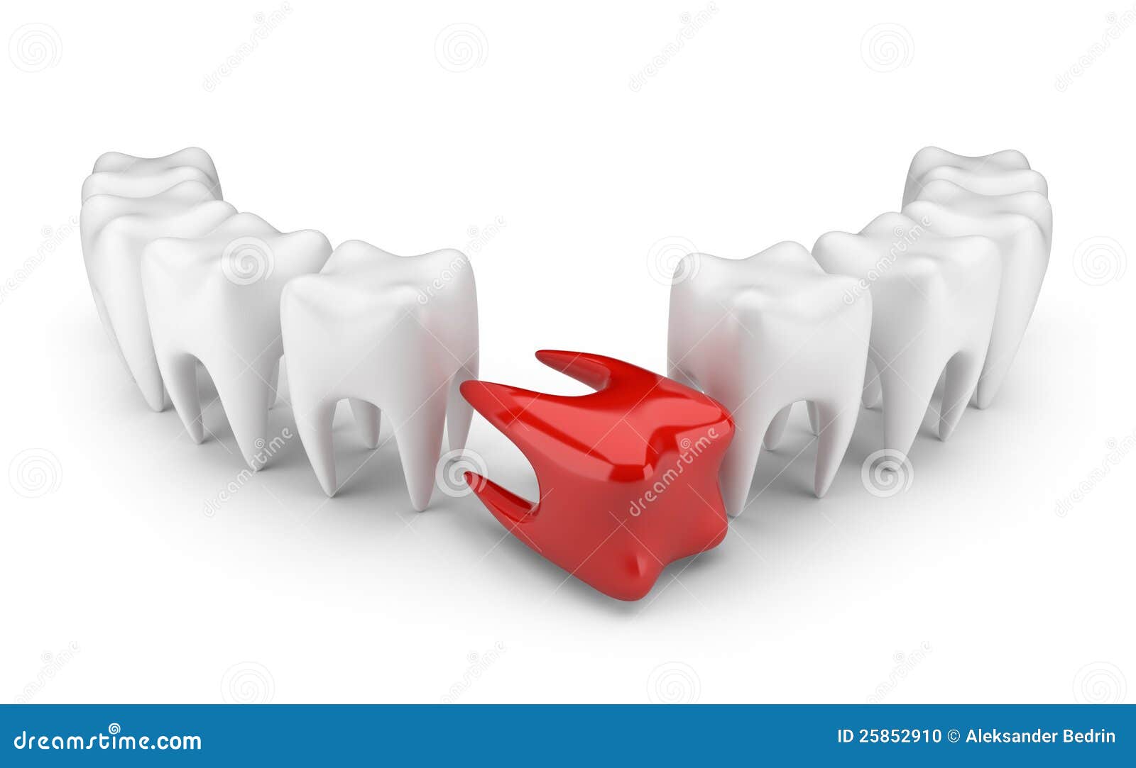 Diente Enfermo 3D. Concepto Dental. Aislado Stock de ilustración ...