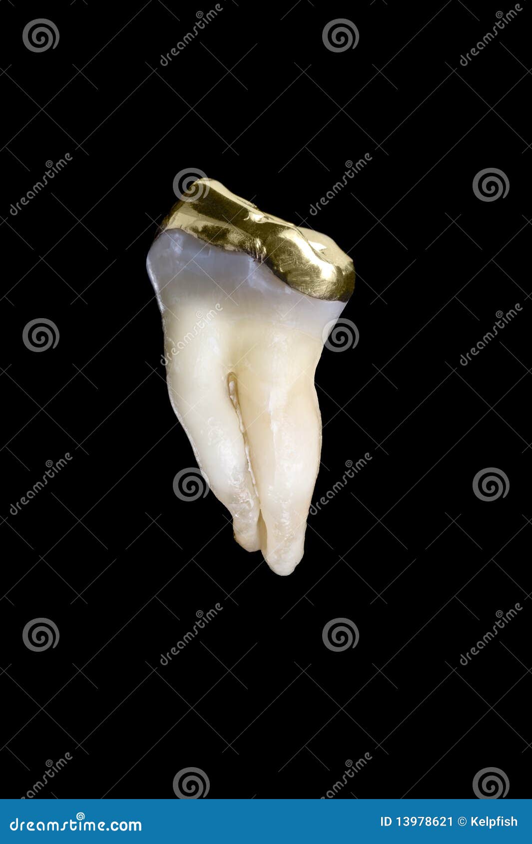 Diente molar humano imagen de archivo. Imagen de muela - 13978621