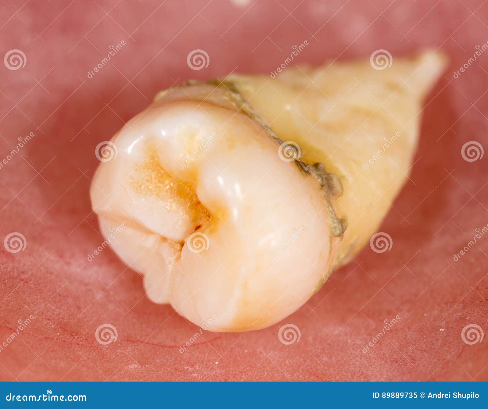 Diente rasgado Macro imagen de archivo. Imagen de fondo - 89889735