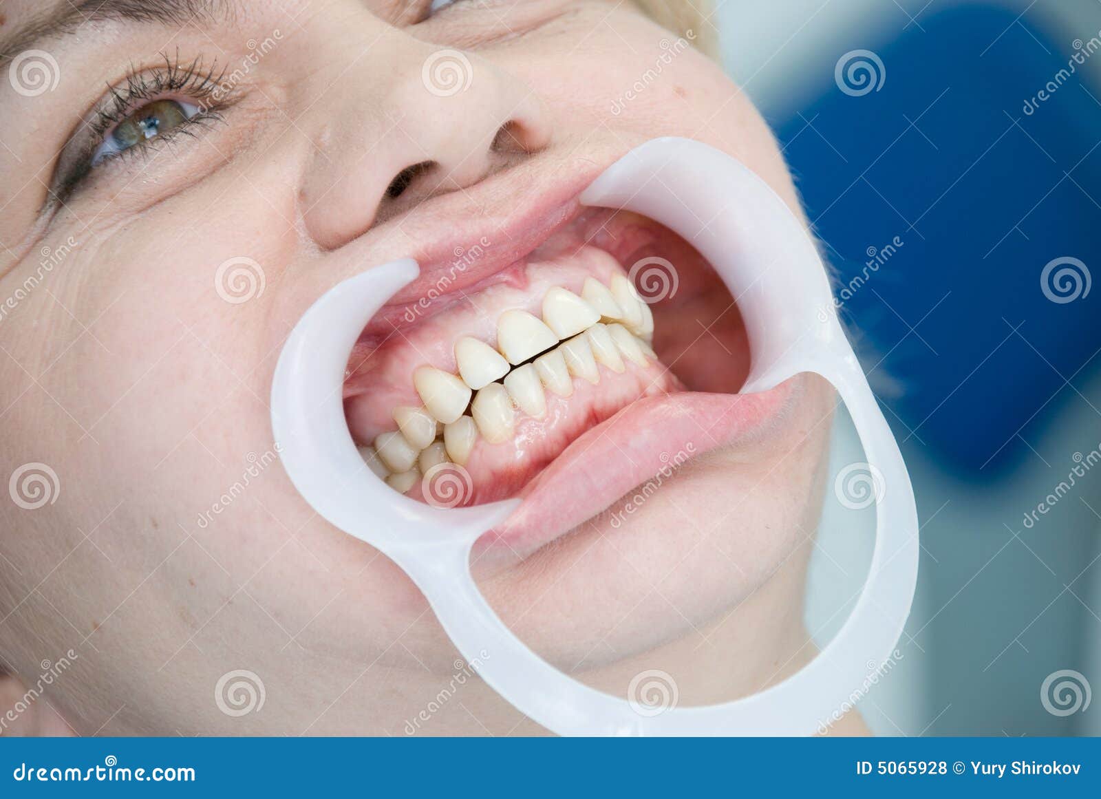 Dientes foto de archivo. Imagen de boca, cara, cavidad - 5065928