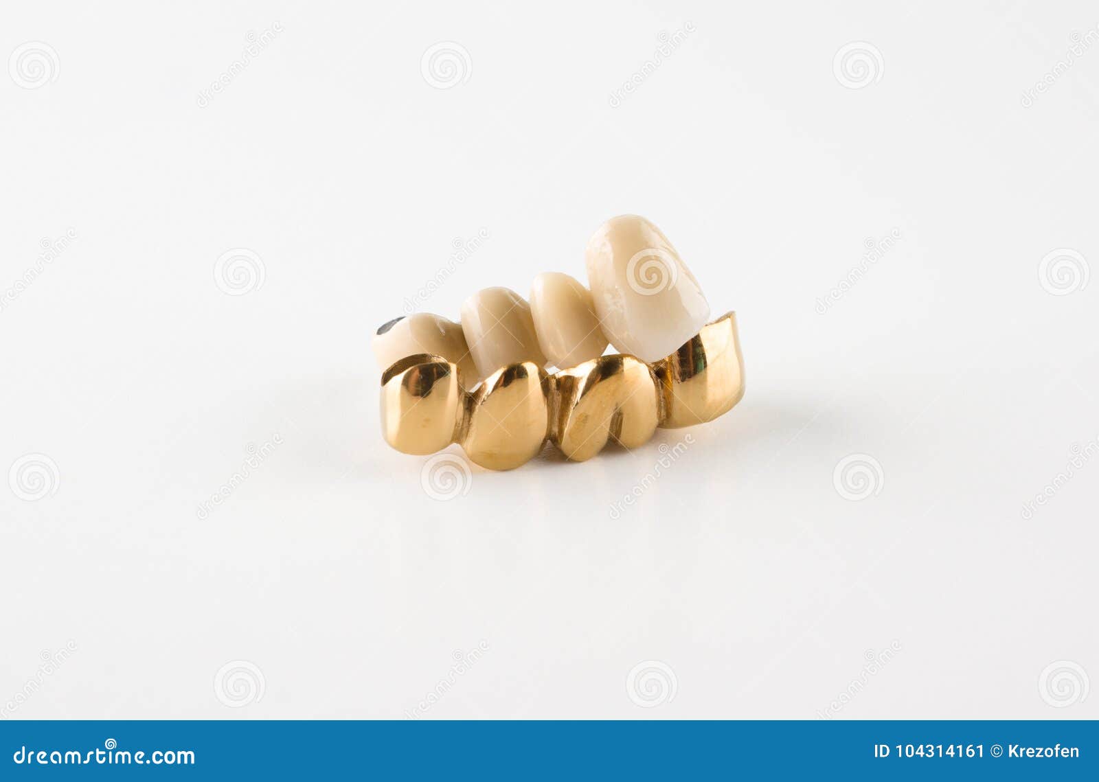 Dientes Artificiales Hechos Del Acero Imagen de archivo - Imagen de ...