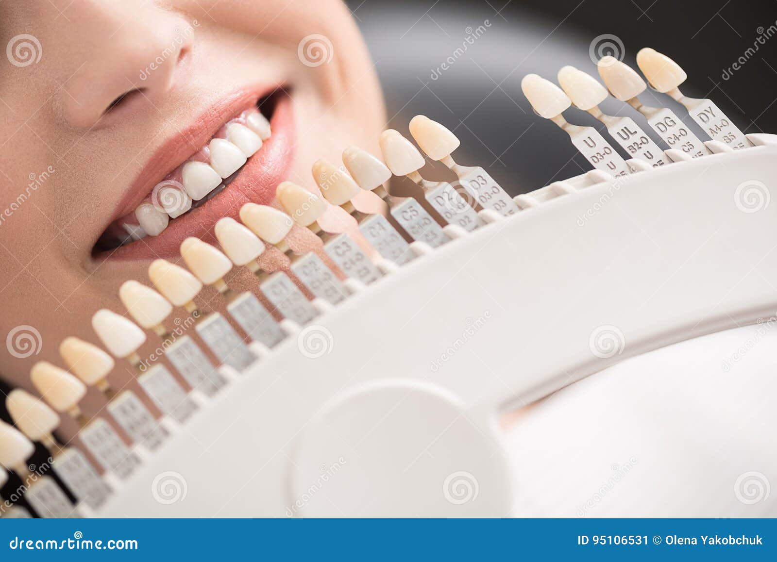 Dientes Artificiales Que Localizan Cerca De Los Labios De La Mujer ...