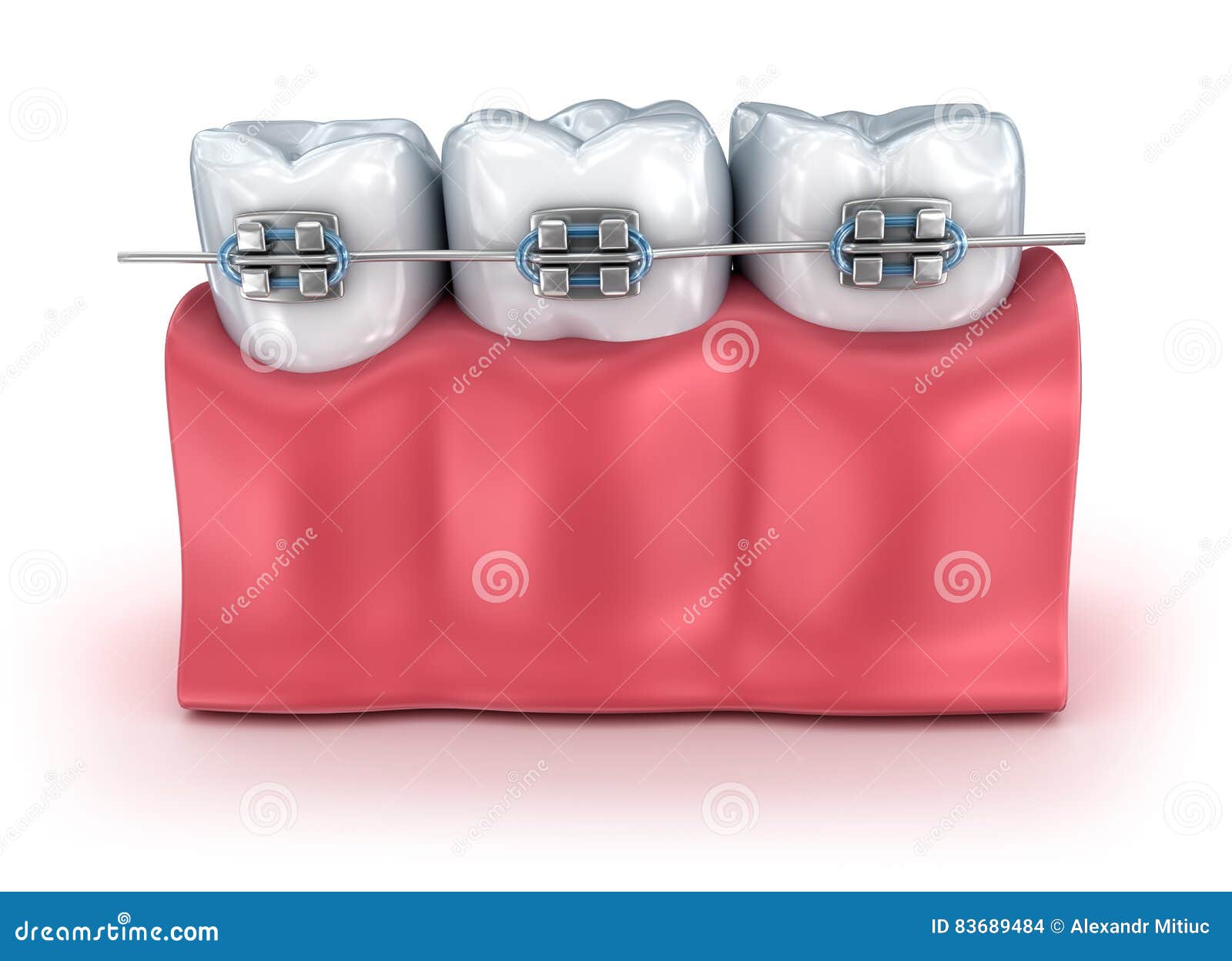 Dientes Con Los Apoyos En Blanco Stock de ilustración - Ilustración de ...