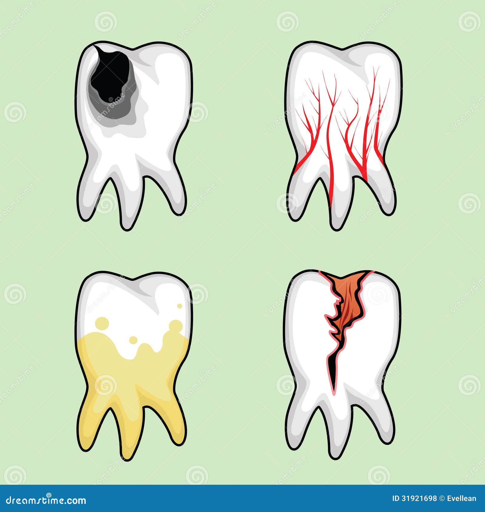 Dientes Enfermos Fotos de archivo libres de regalías - Imagen: 31921698