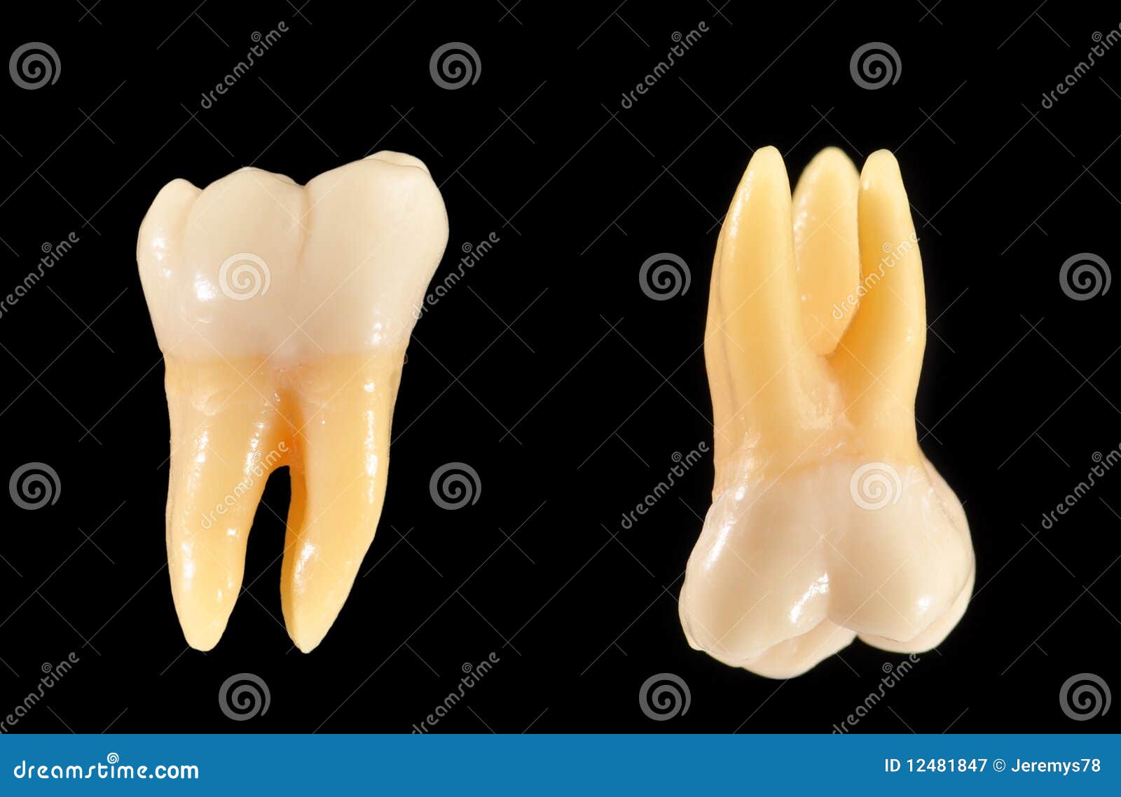 Diente molar; Dientes Molares; Molar; Molares; Muela; Muelas