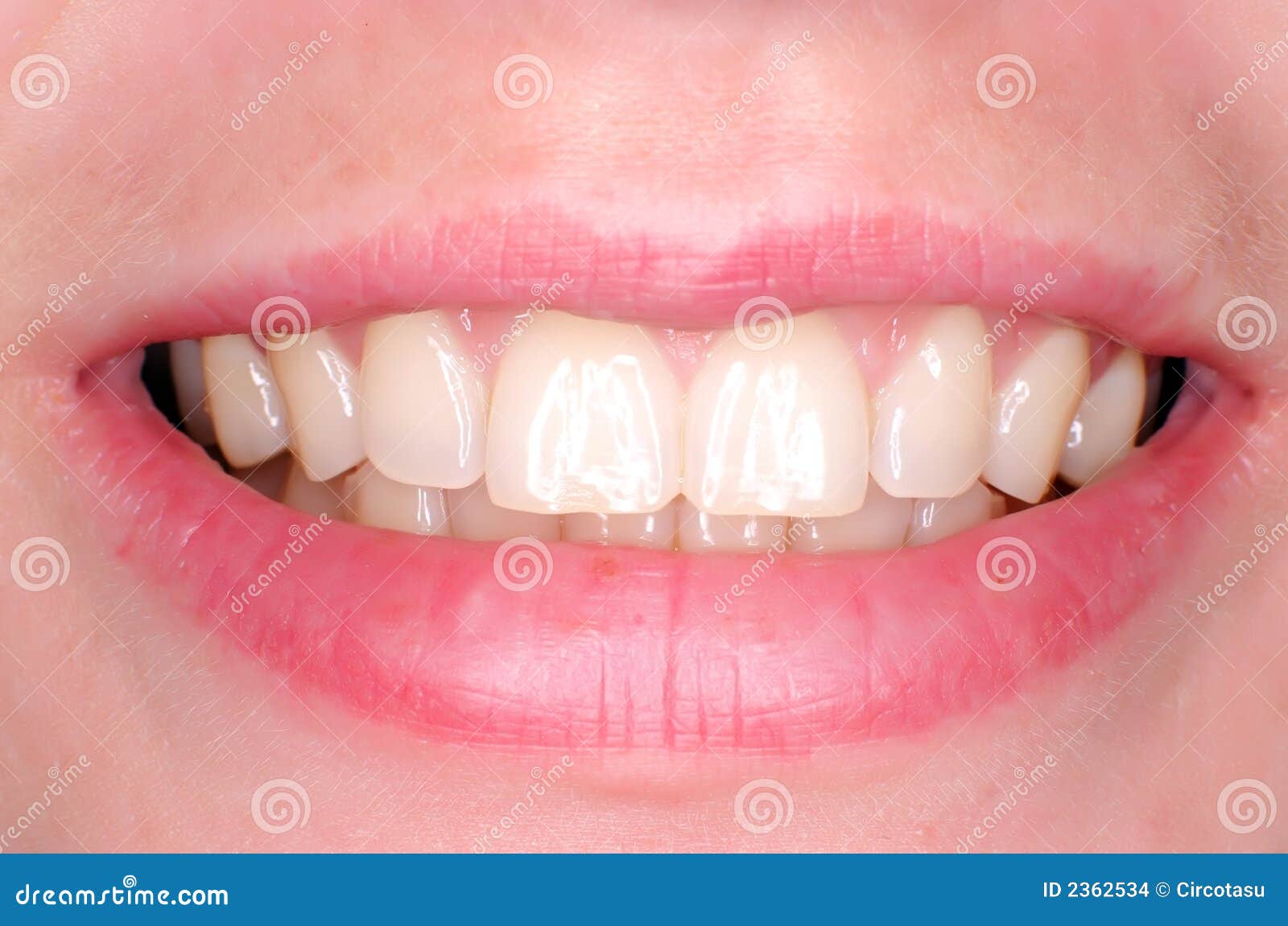 Dientes Perfectos Imagenes de archivo - Imagen: 2362534