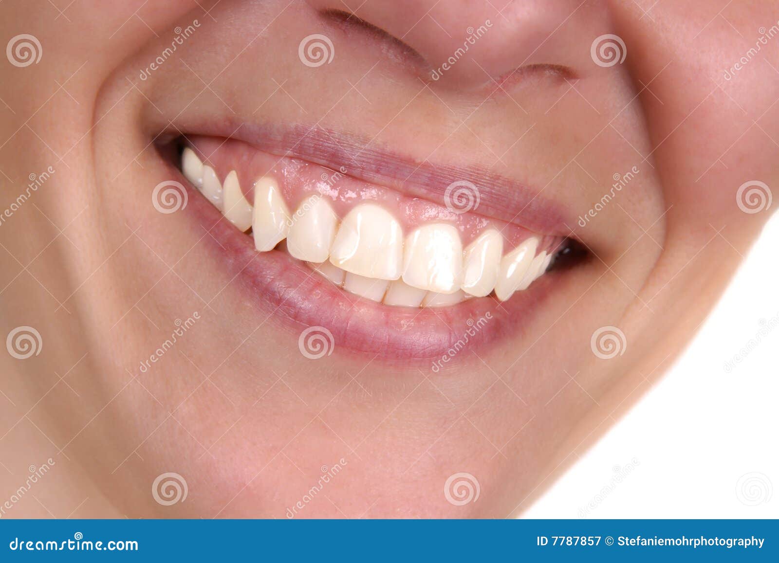 Dientes perfectos imagen de archivo. Imagen de travieso - 7787857