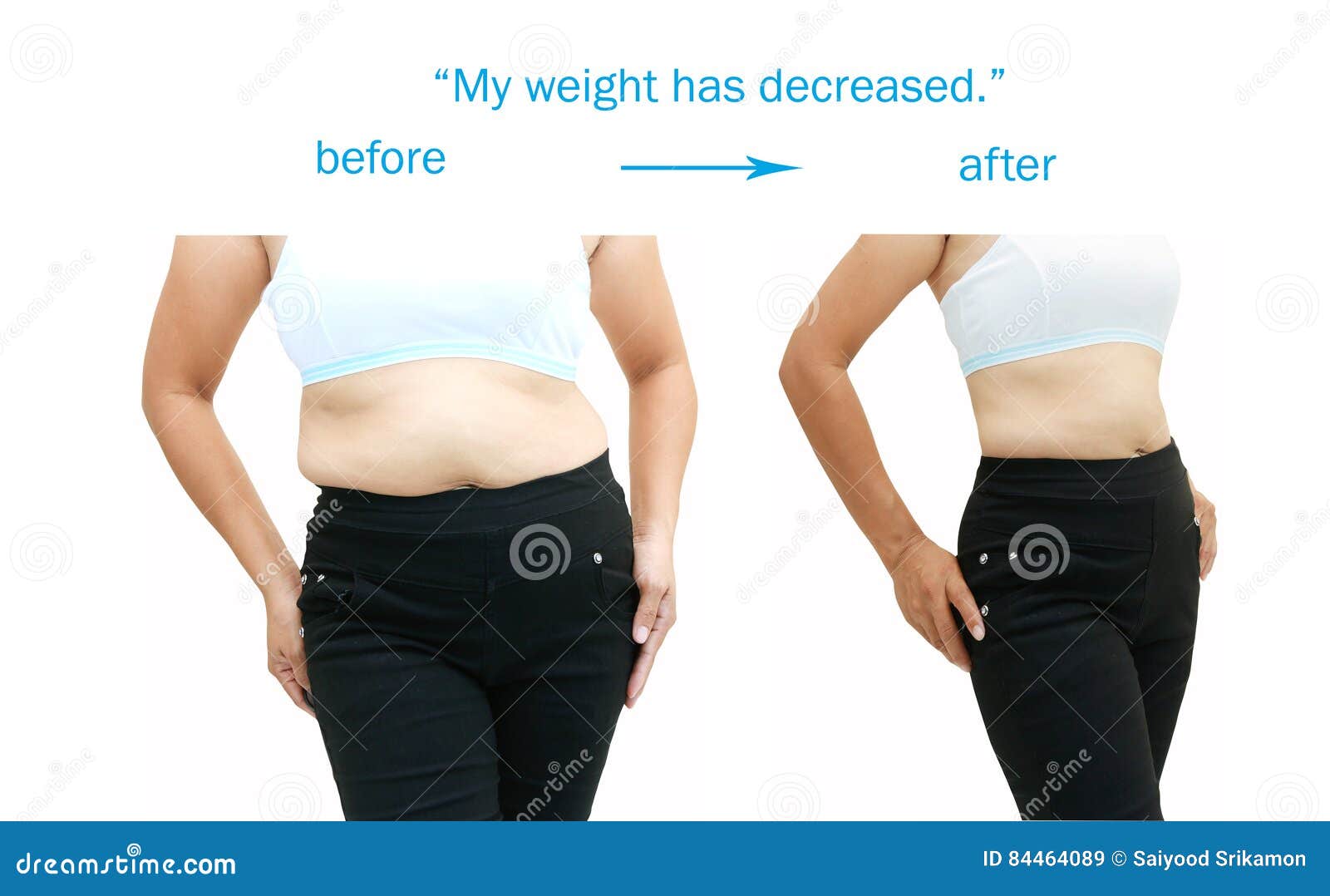After a diet stock image. Image of excess, obesity, cellulite - 84464089