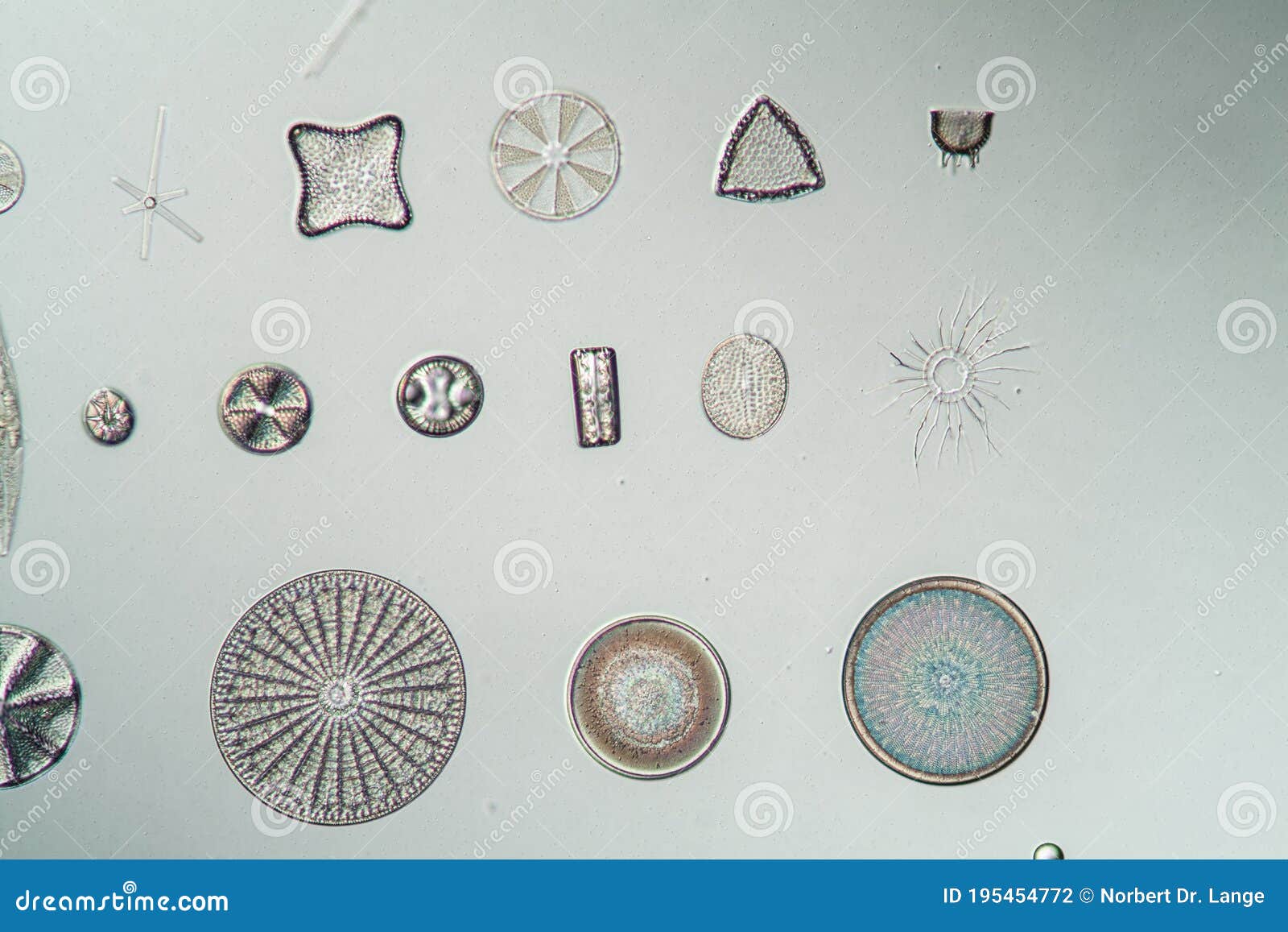 Diferentes Tipos De Diatomeas Foto de archivo - Imagen de macro ...