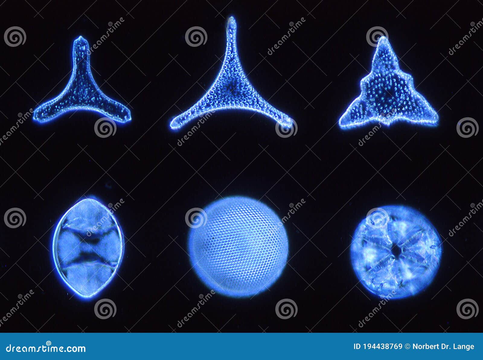 Different Diatoms Under The Microscope Royalty-Free Stock Photo ...