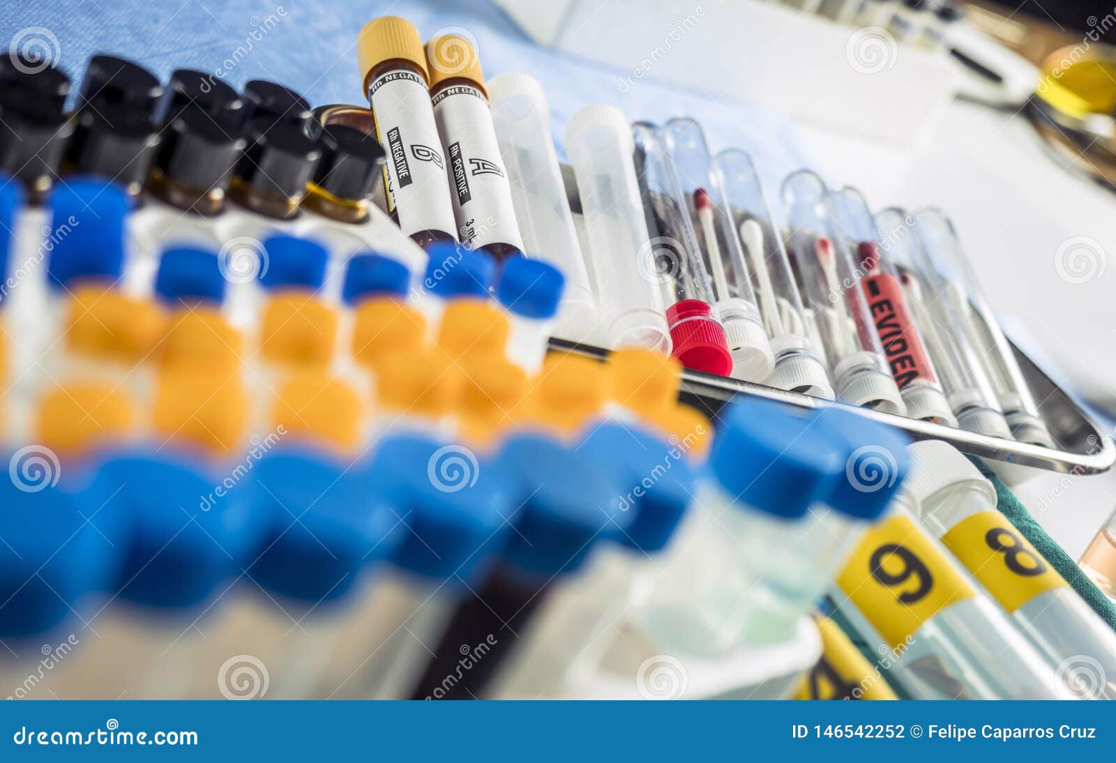 Different Samples With Kinds Of Bacterias Living At Common Household ...