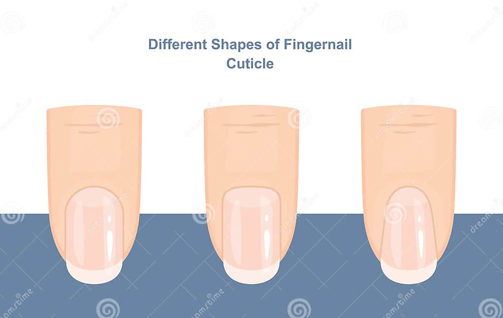 Different Shapes of Fingernail Cuticles. Manicure Guide. Vector Stock ...