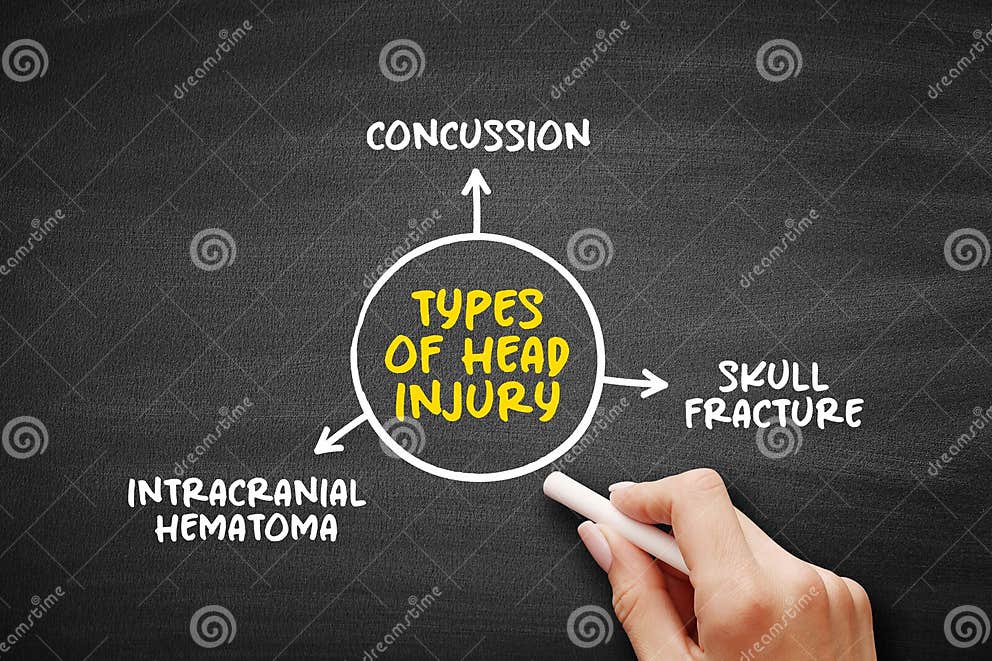 Different Types of Head Injury, Mind Map Text Concept for Presentations ...