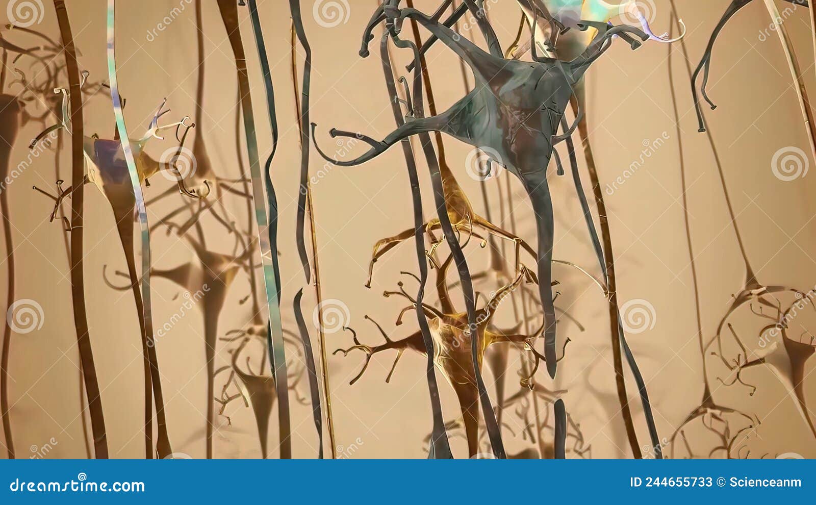 Diffuse Axonal Injury; is Caused by a Combination of Acceleration ...